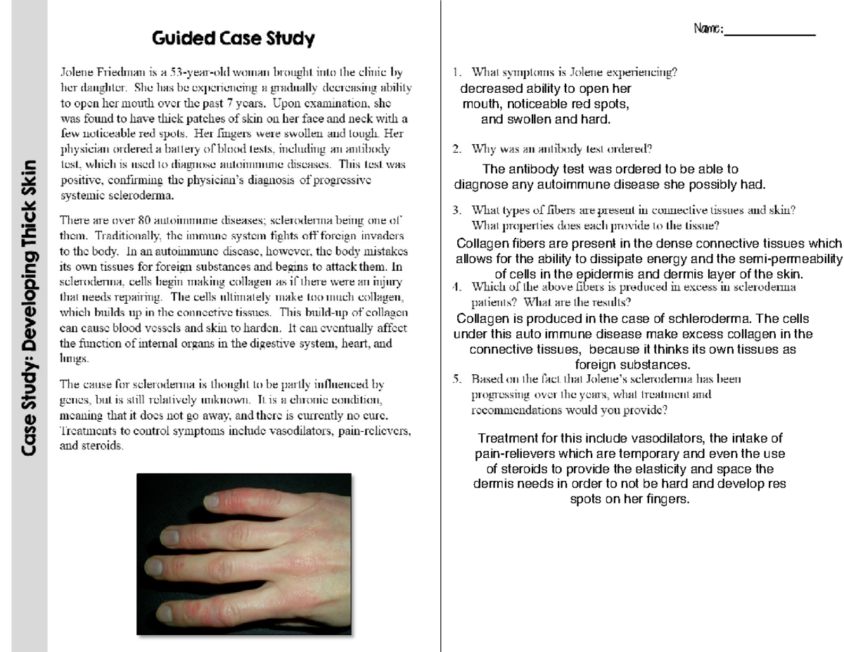 Scleroderma Case Study- Student Guided - Studocu