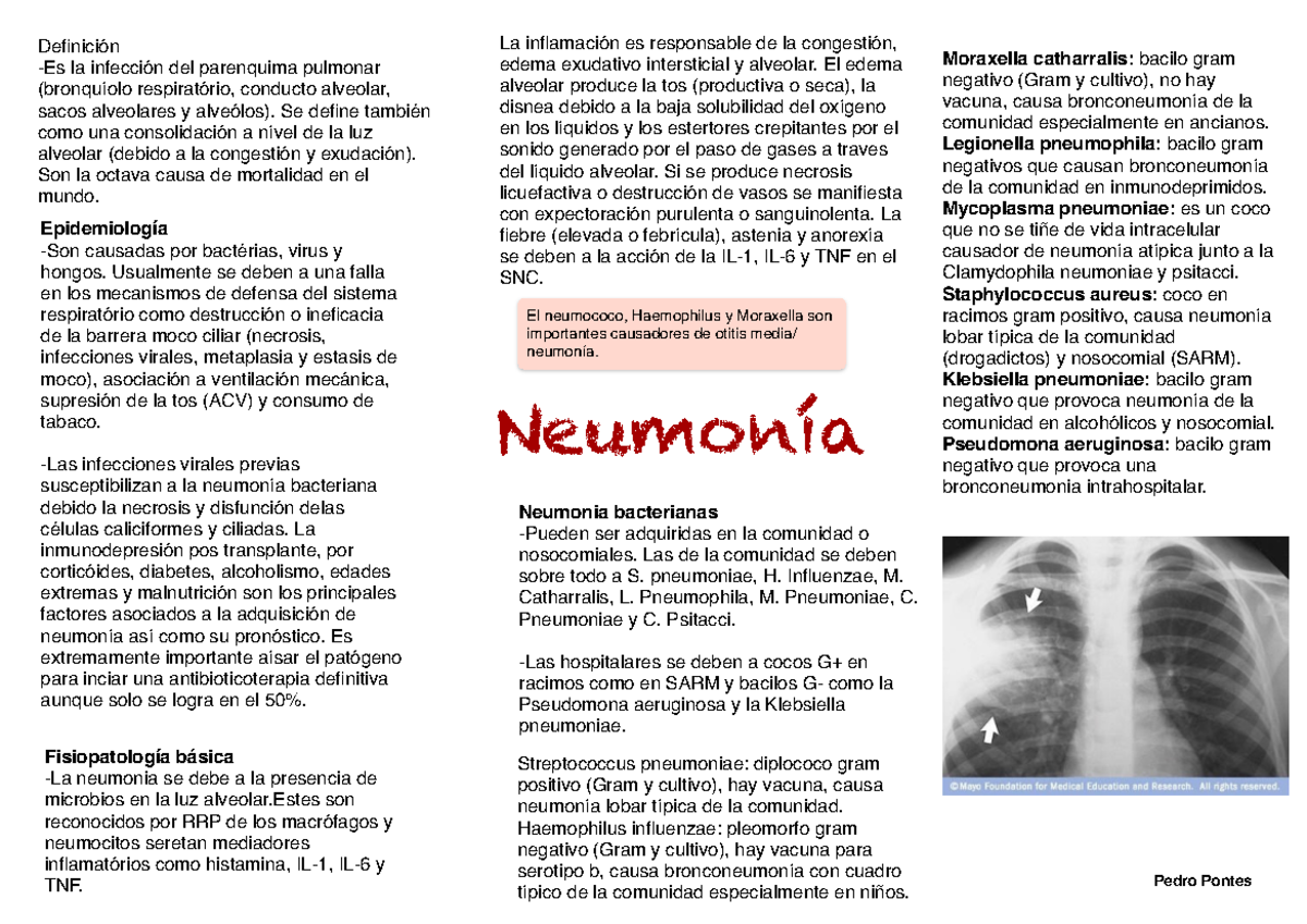 3- Neumonía - Apunte semiologian - Neumonía Definición -Es la infección ...