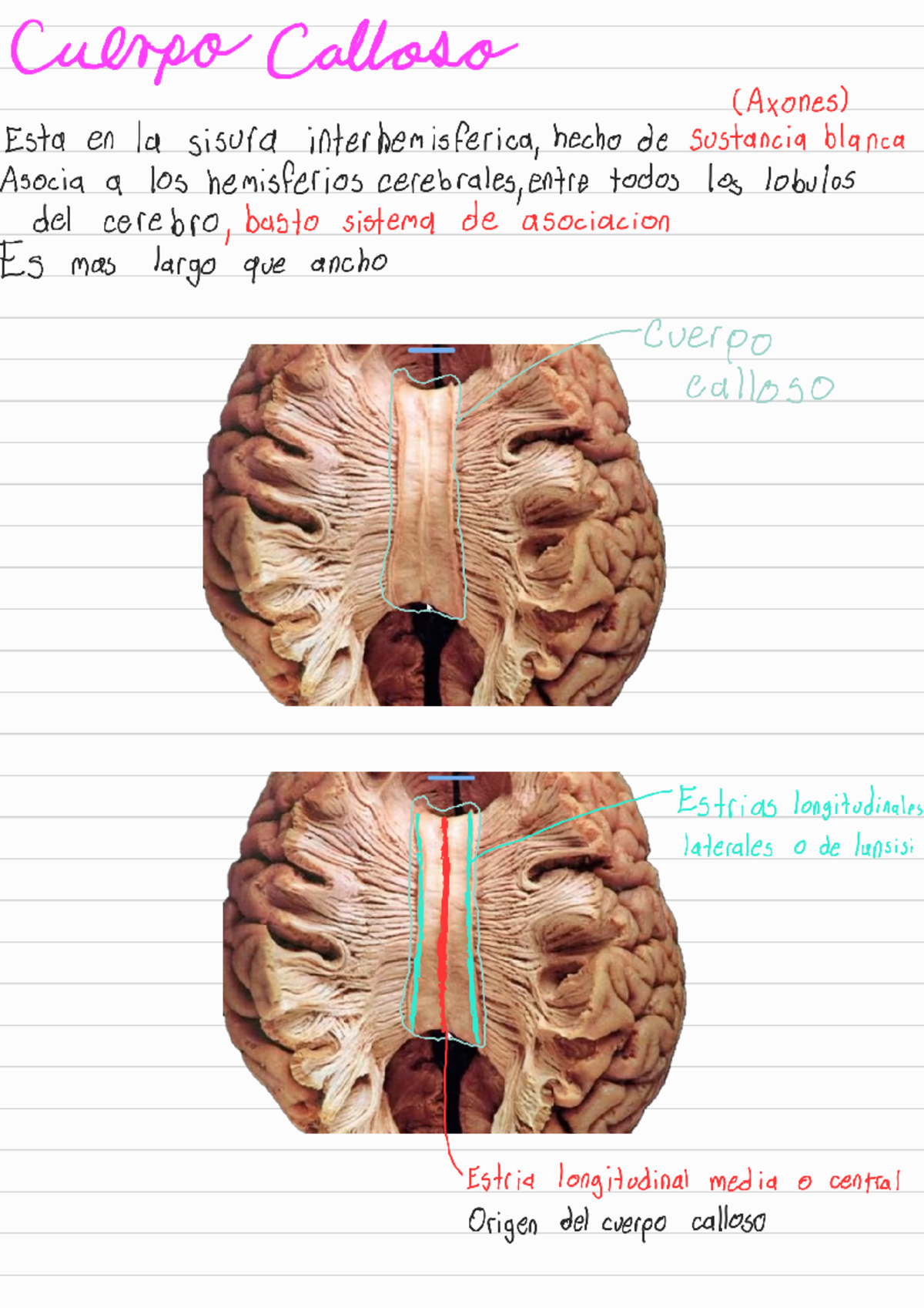 Cuerpo calloso 240508 122815 - Cuerpo Calloso (Axones) Esta en la ...
