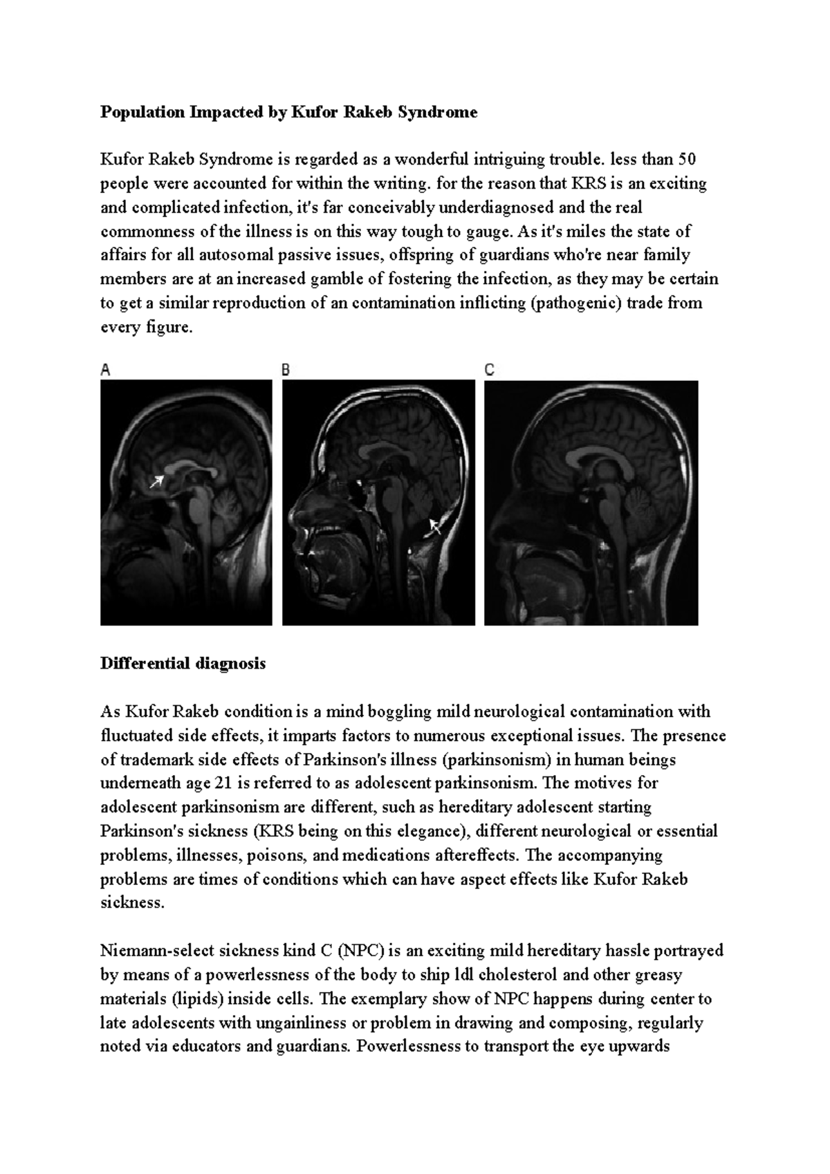 Management of Kufor Rakeb Syndrome-1 - Population Impacted by Kufor ...