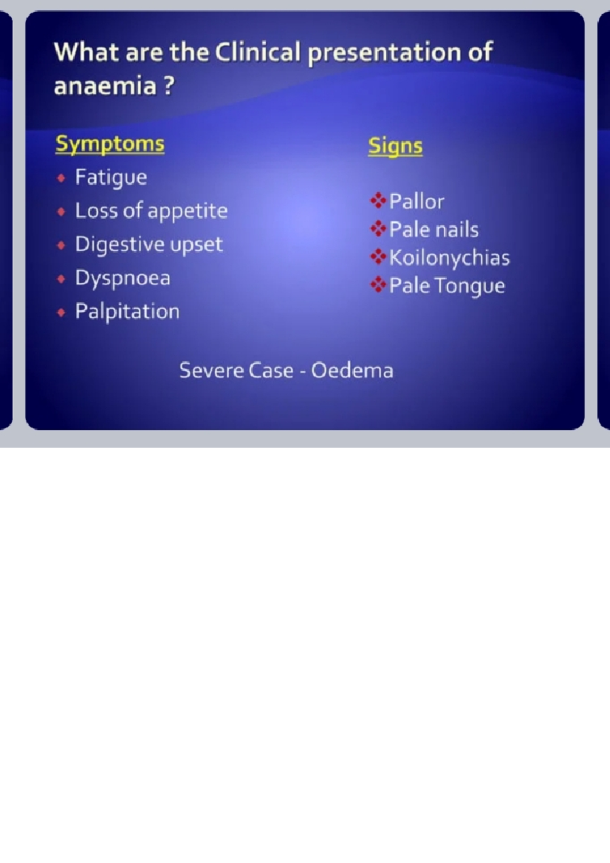 Anemia 4 - e P e are e anaemia ? Symptoms Signs Fatigue Pallor Loss of ...