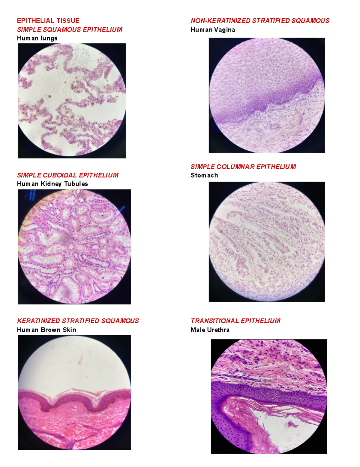 Histology - Notes - EPITHELIAL TISSUE SIMPLE SQUAMOUS EPITHELIUM Human ...