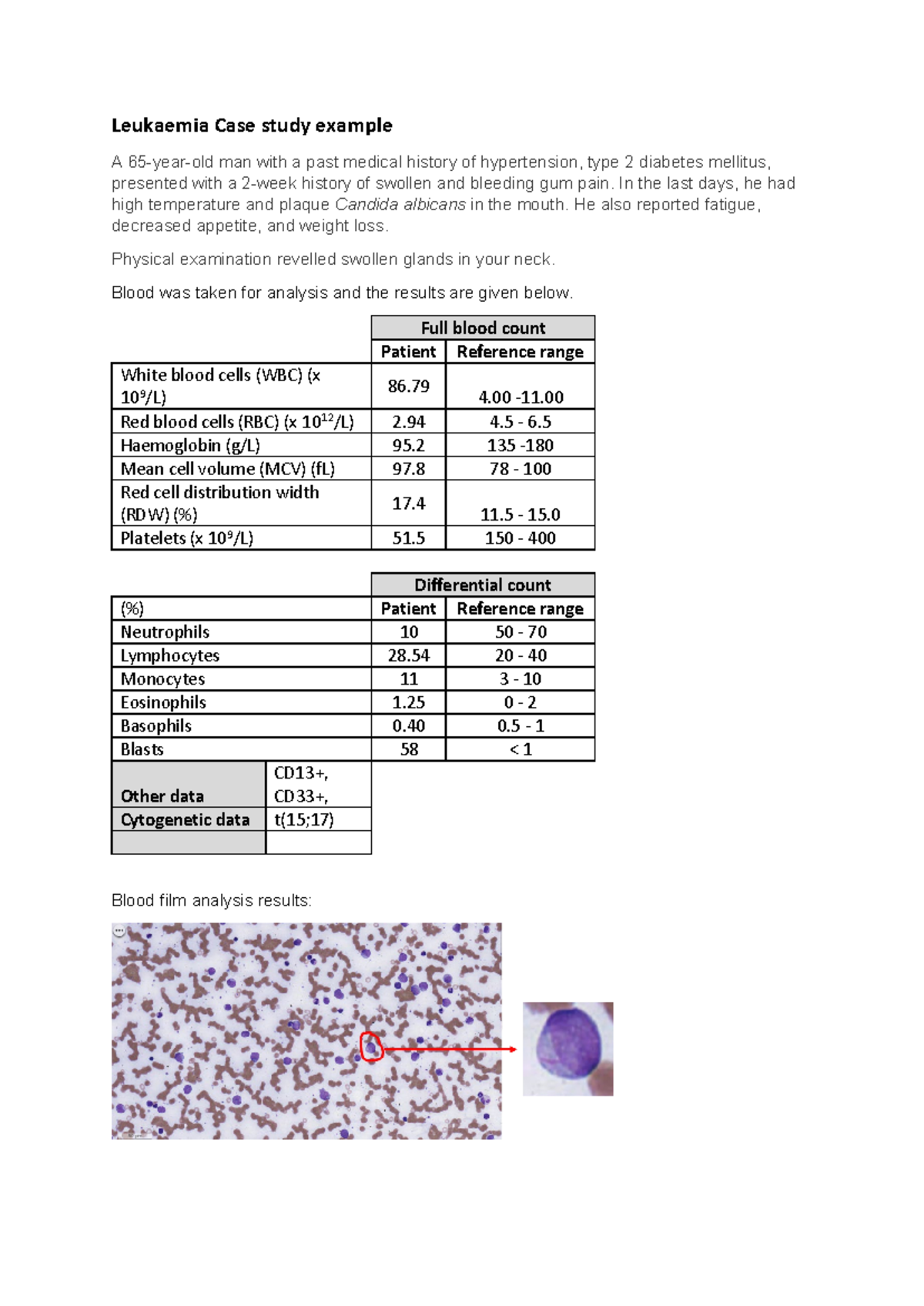 Leukaemia Case study example for the coursework - Leukaemia Case study ...