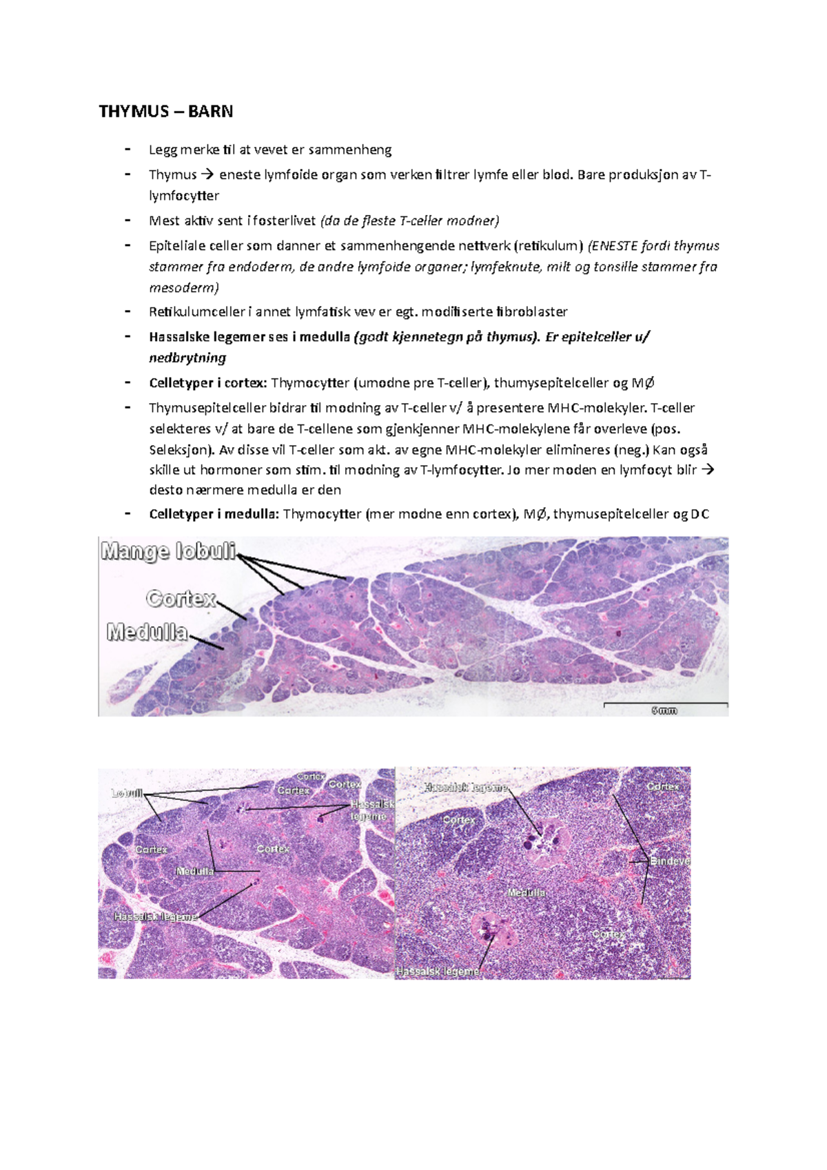 Histologi: Thymus, lymfeknute, milt - THYMUS – BARN - Legg merke til at ...