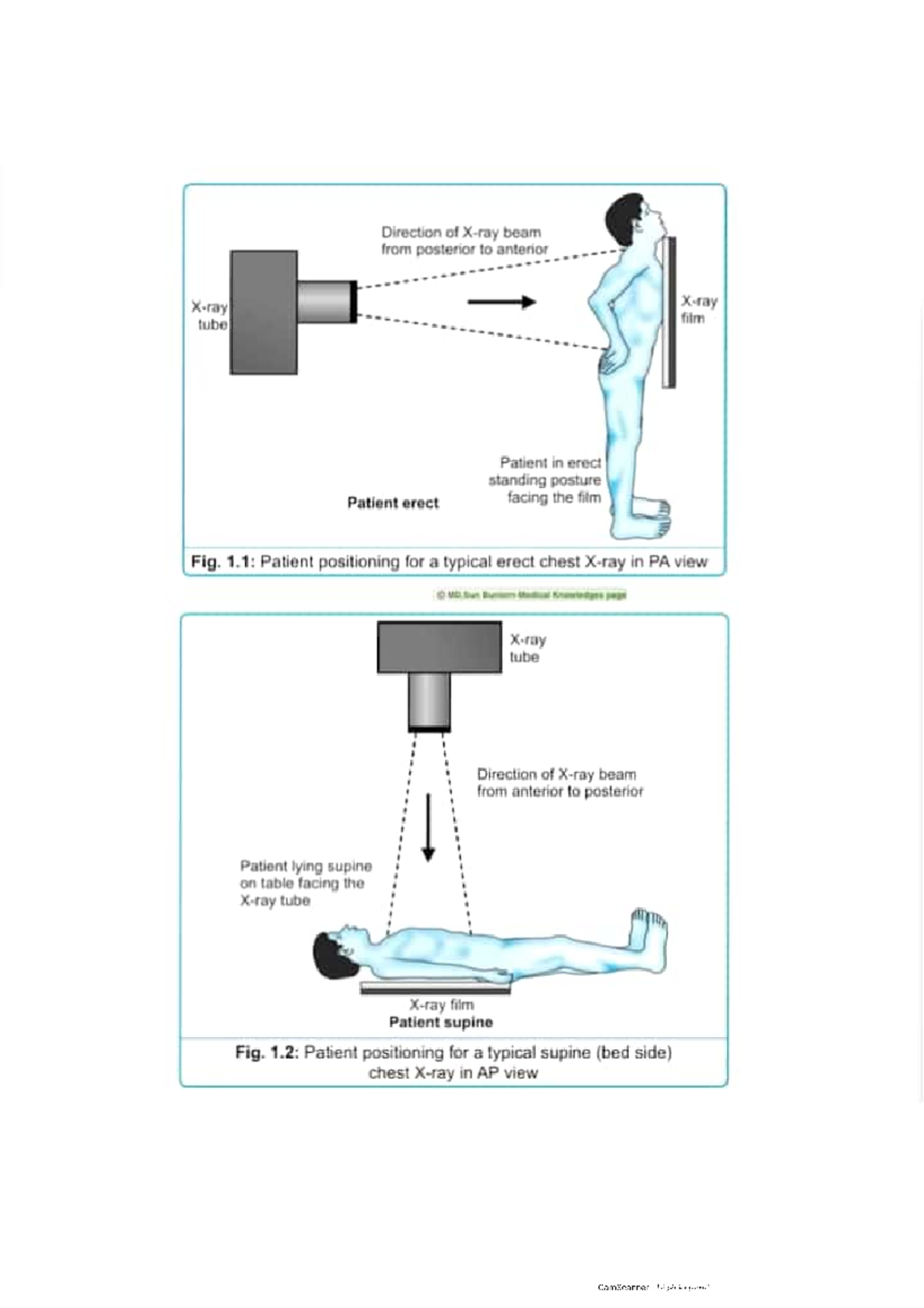 X-Ray interpretation - physiology pathology - Studocu