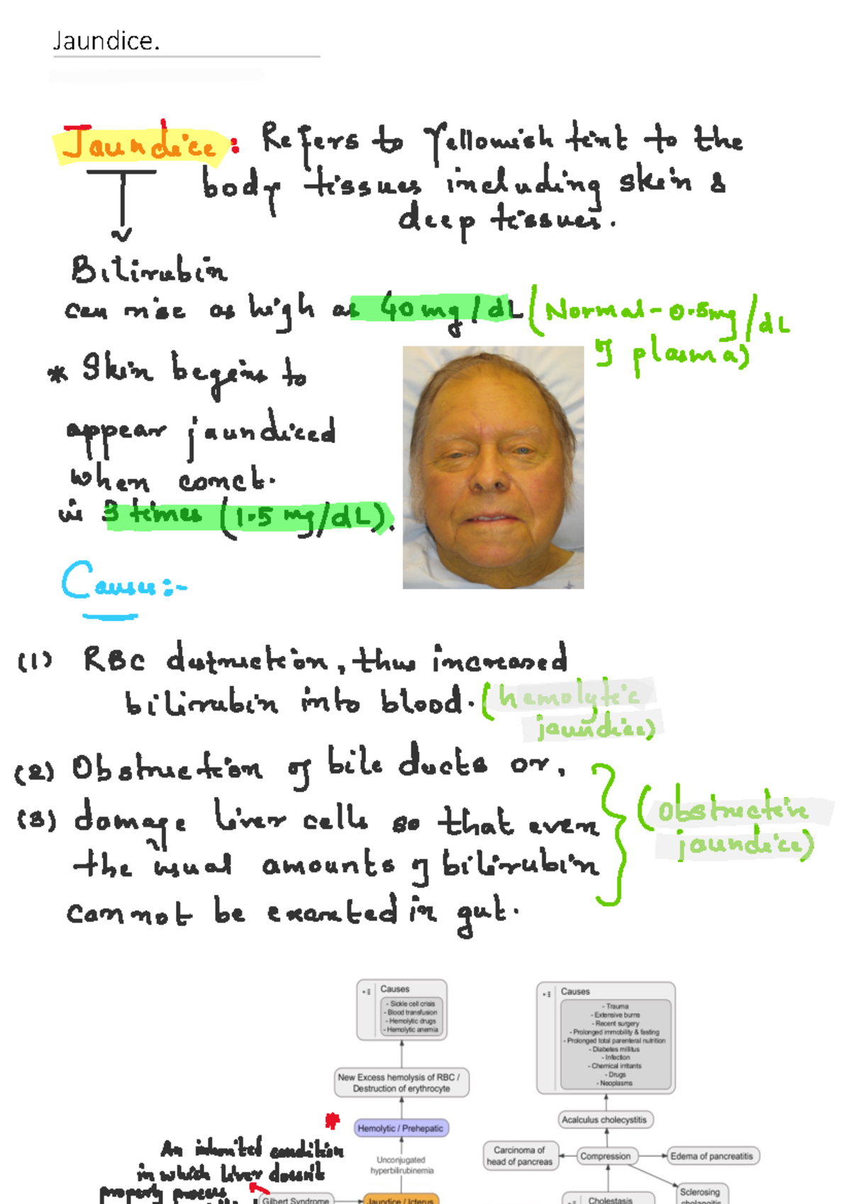 9. Jaundice - Notes - NURS 1341 - :ĂƵŶĚŝĐĞ͘ ^ƵŶĚĂLJ͕ ϭϯ KĐƚŽďĞƌ ϮϬϭε κ͗ ...