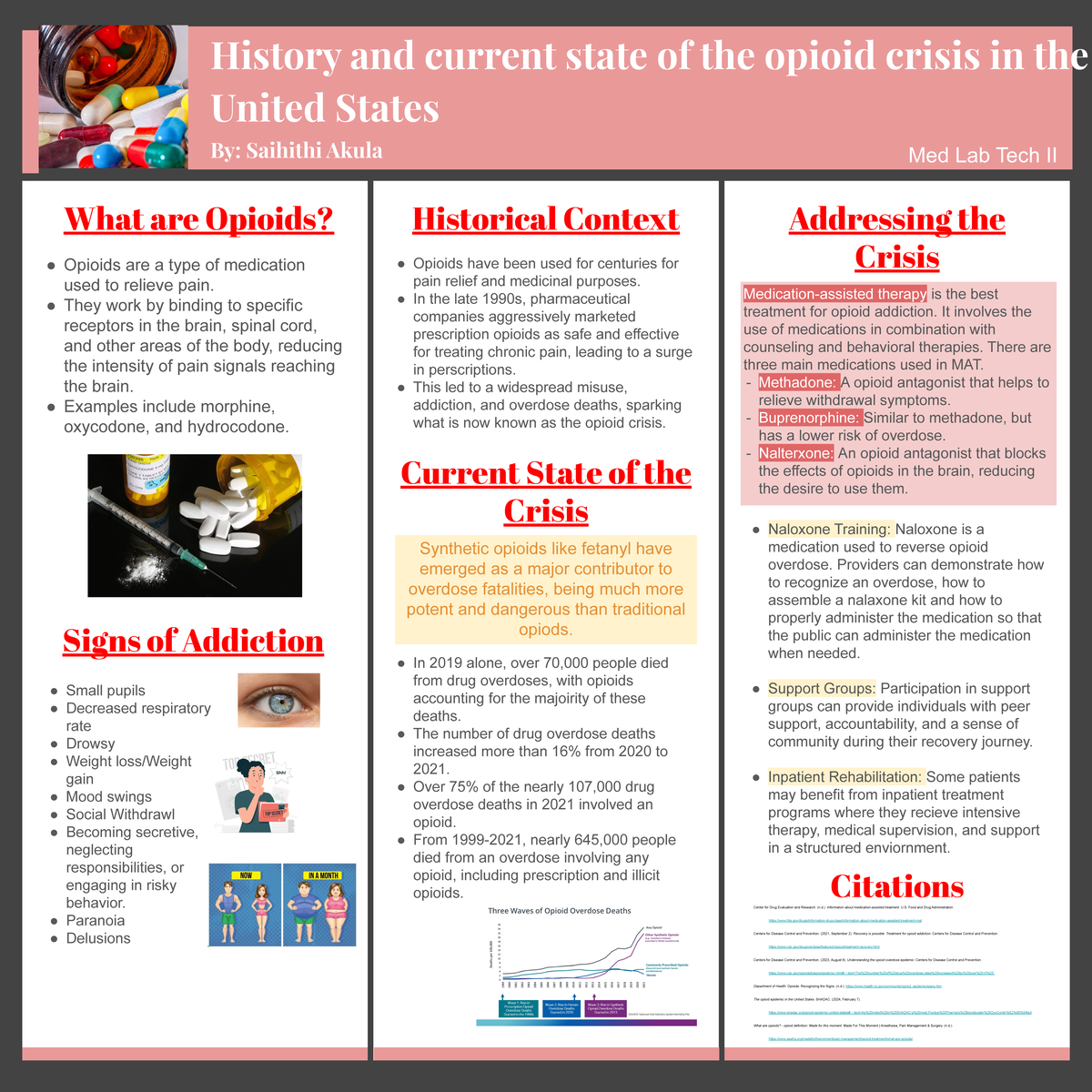Opioid poster - Saihithi Akula - History and current state of the ...
