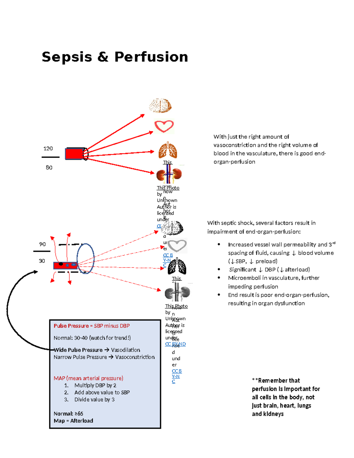 Sepsis and Perfusion quick explanation - This Pho to by Unk now n Aut ...