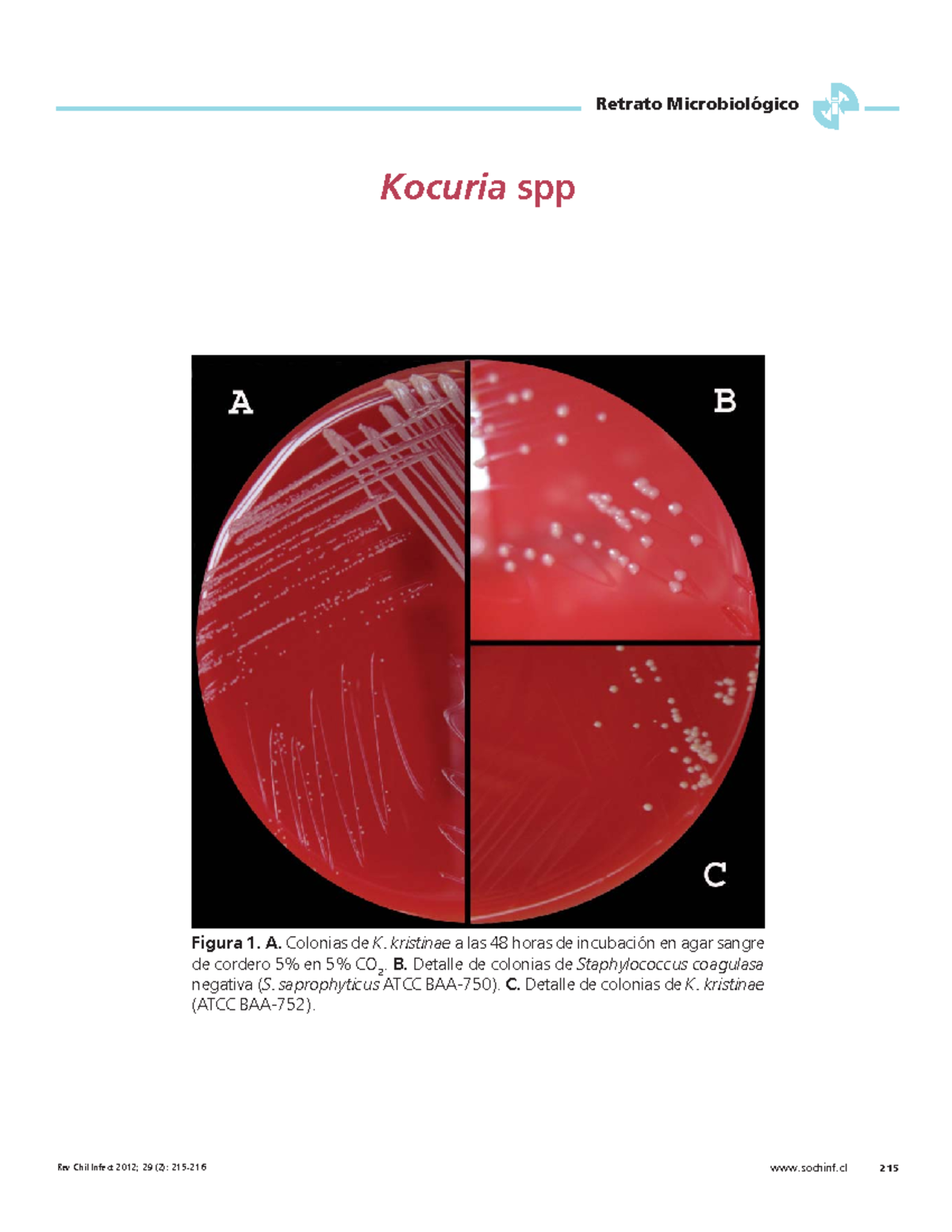 Kocuria sp (retrato) - Retrato Microbiológico sochinf 215 Kocuria spp ...