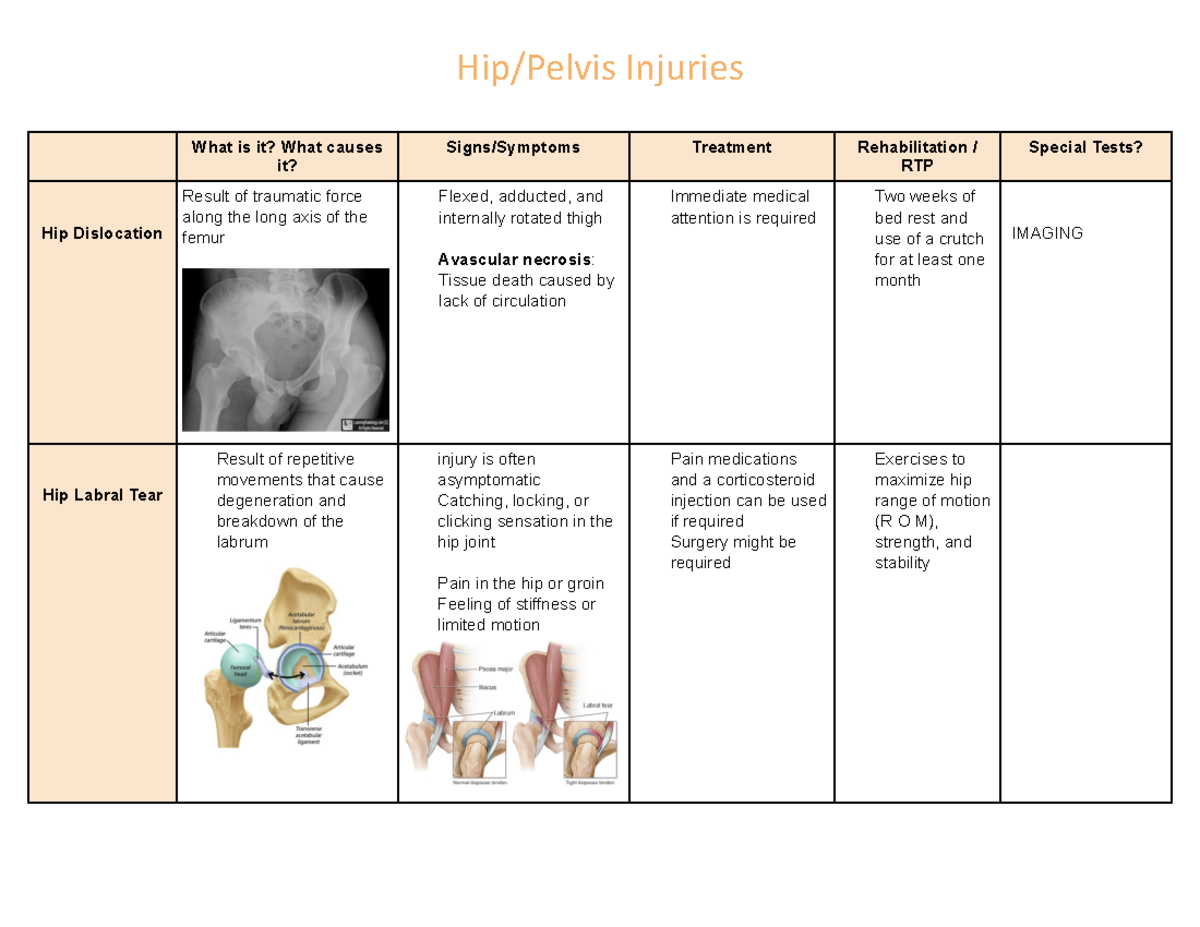 Hip Injury Table Organizer - Hip/Pelvis Injuries What is it? What ...