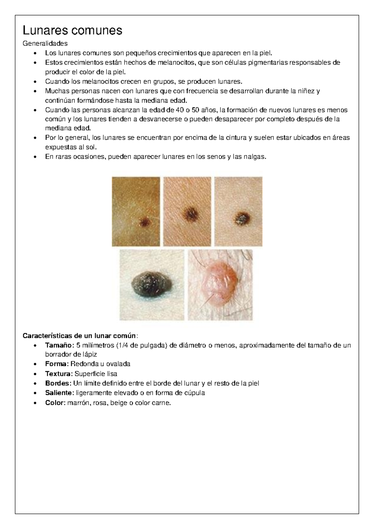 Lunares - tarea - Lunares comunes Generalidades - Los lunares comunes ...