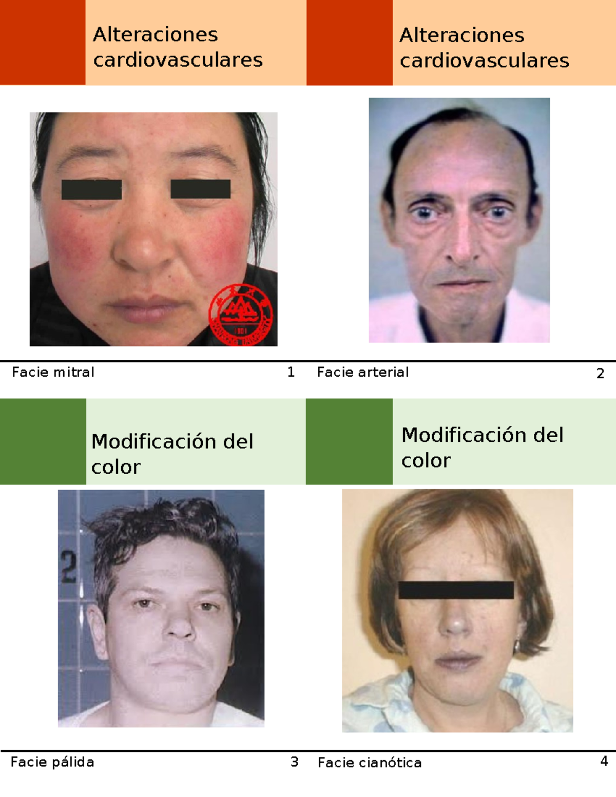 Flash card de facies - Alteraciones cardiovasculares Alteraciones ...