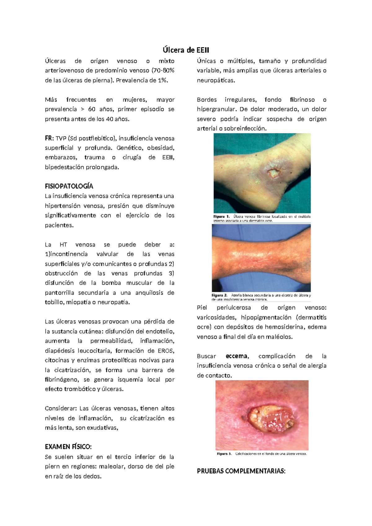 Cirugía Úlceras EEII - cir - Úlcera de EEII Úlceras de origen venoso o ...