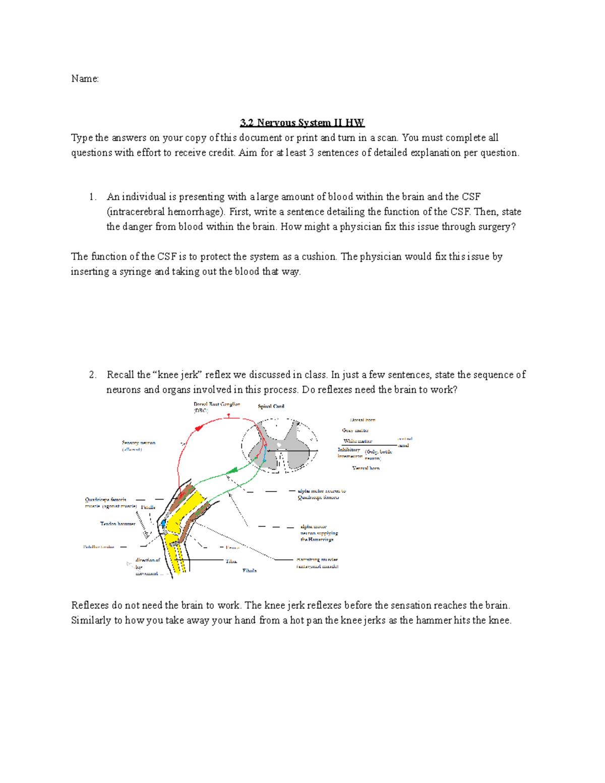 3.2 Nervous System II HW - Name: 3 Nervous System II HW Type the ...