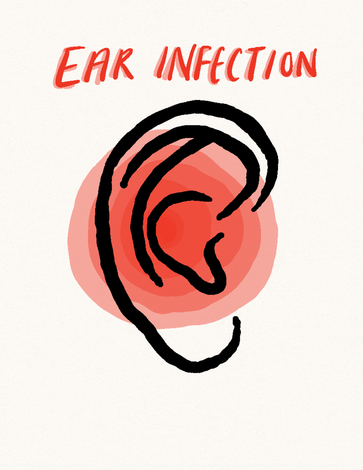 Ear infection - Lecture notes 3 - EAR INFECTION qq iii if of it E ...