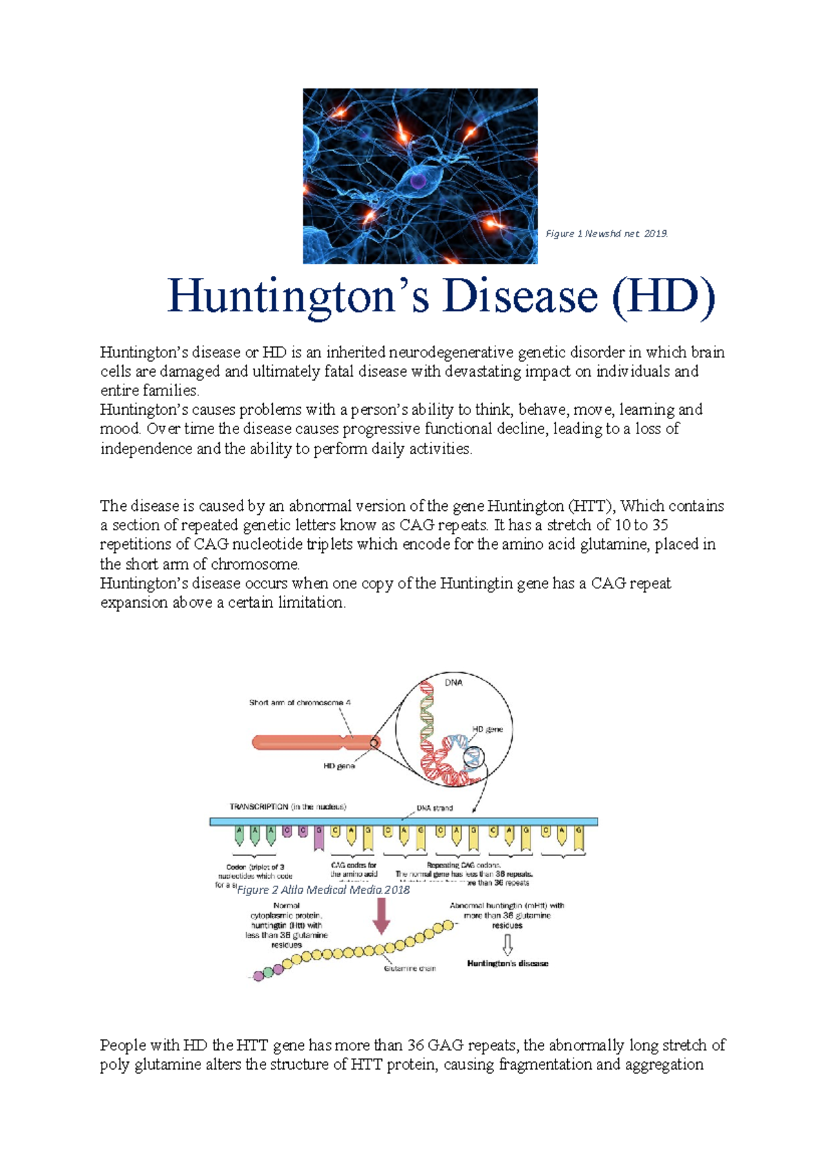 Huntington's Disease - BY2PA2 - Aston - Studocu