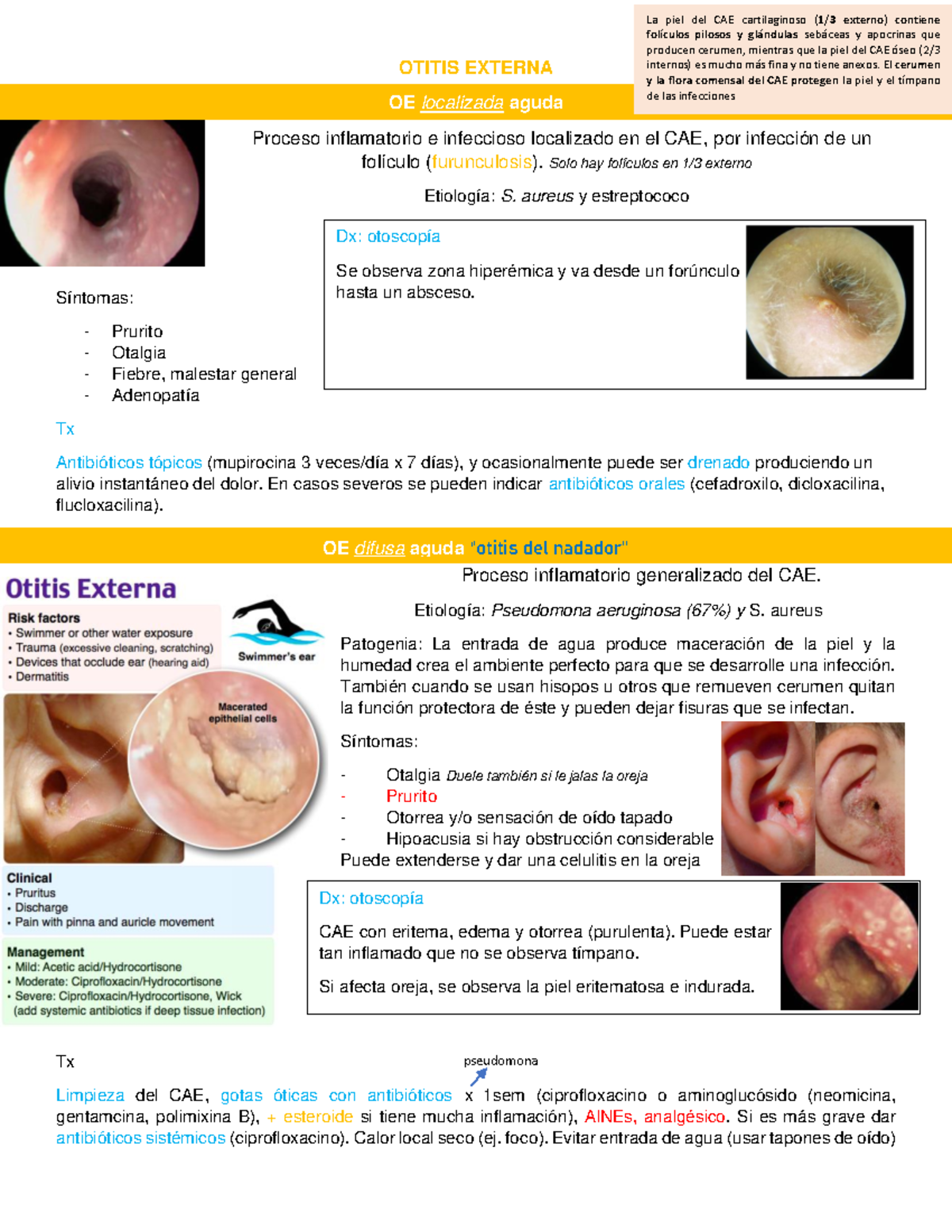 Otitis Externa - Resume OE - OE difusa aguda ʬʭotitis del nadadorʭʭ OTITIS EXTERNA OE localizada ...