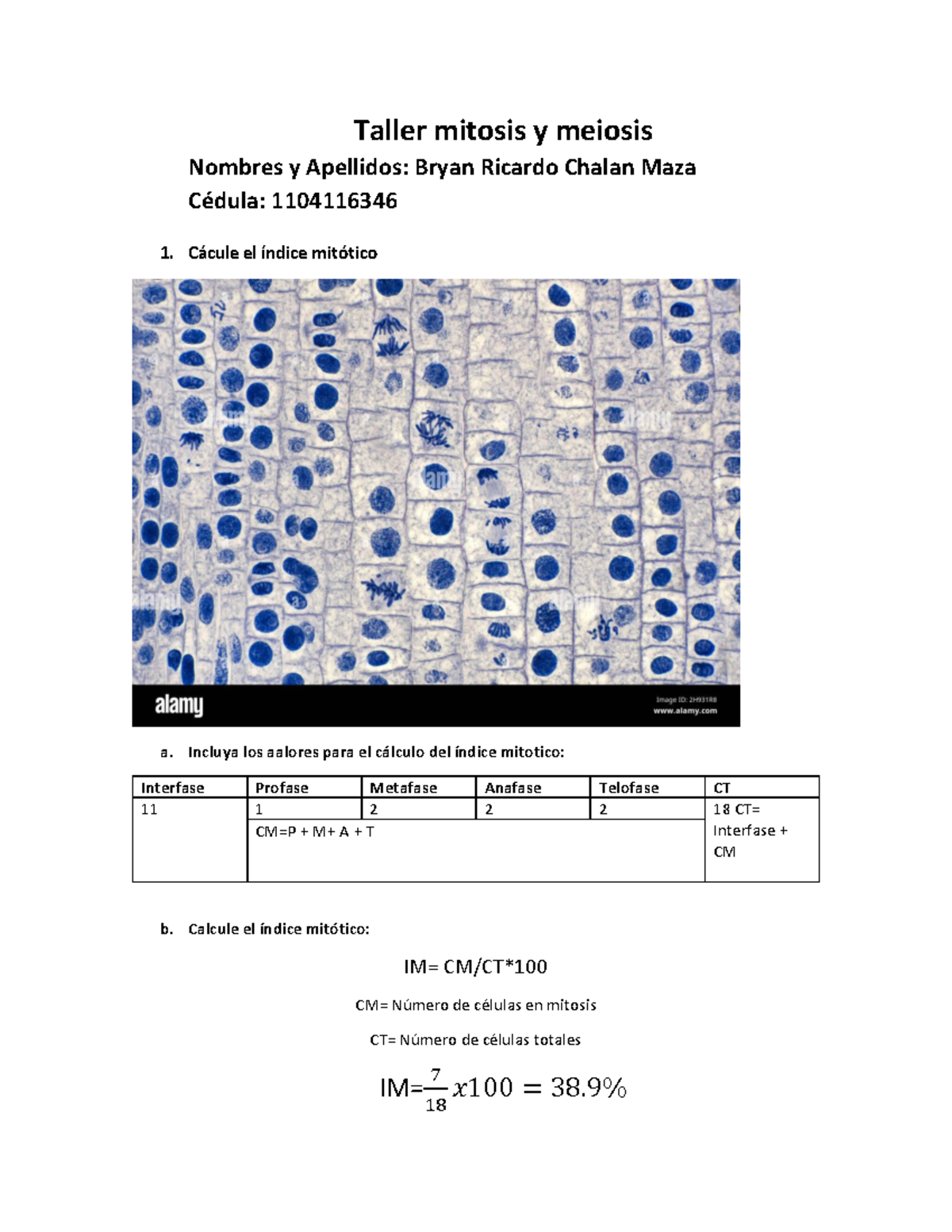 Taller Mitosis y Meiosis - Taller mitosis y meiosis Nombres y Apellidos: Bryan Ricardo Chalan ...