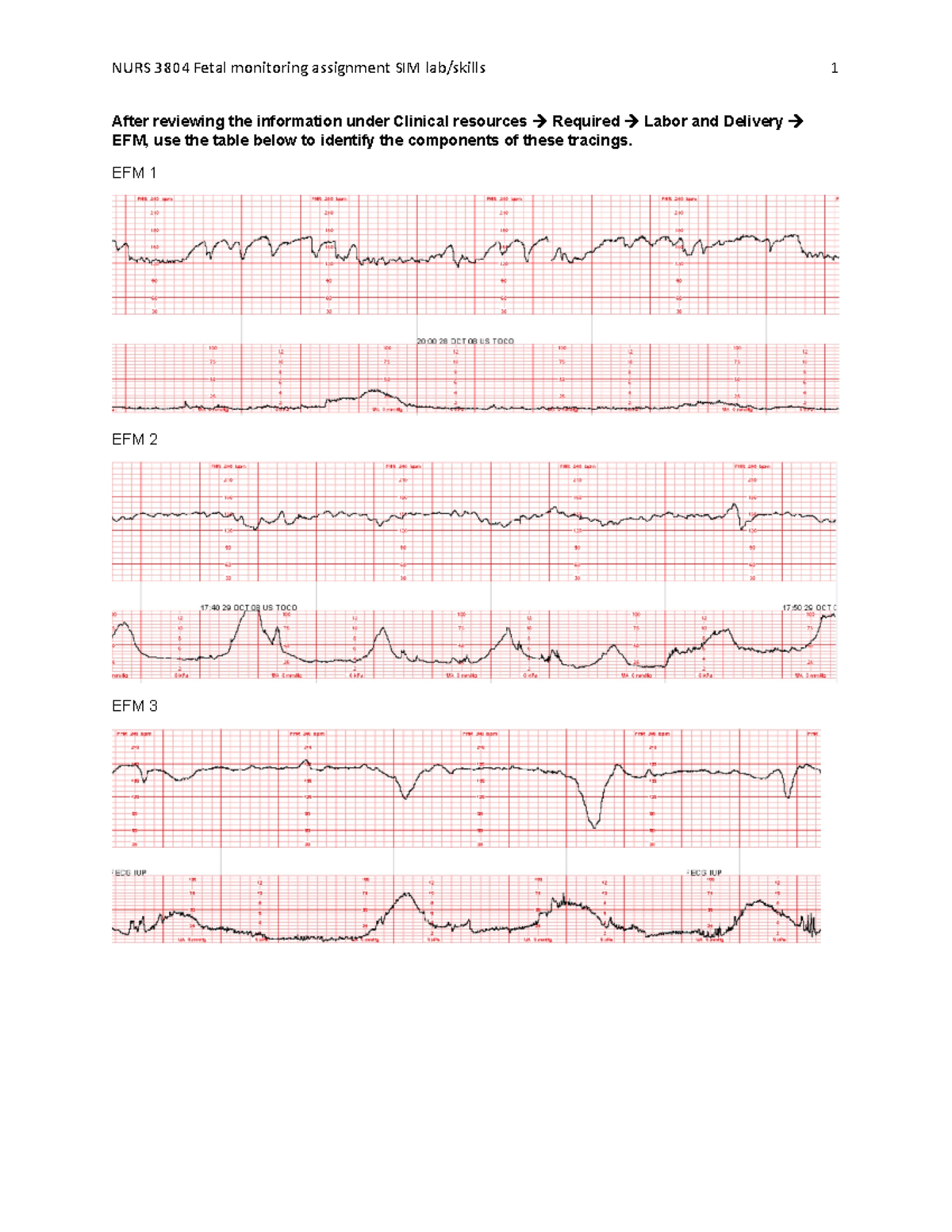 Electronic Fetal Monitoring - NURS 3804 Fetal monitoring assignment SIM ...