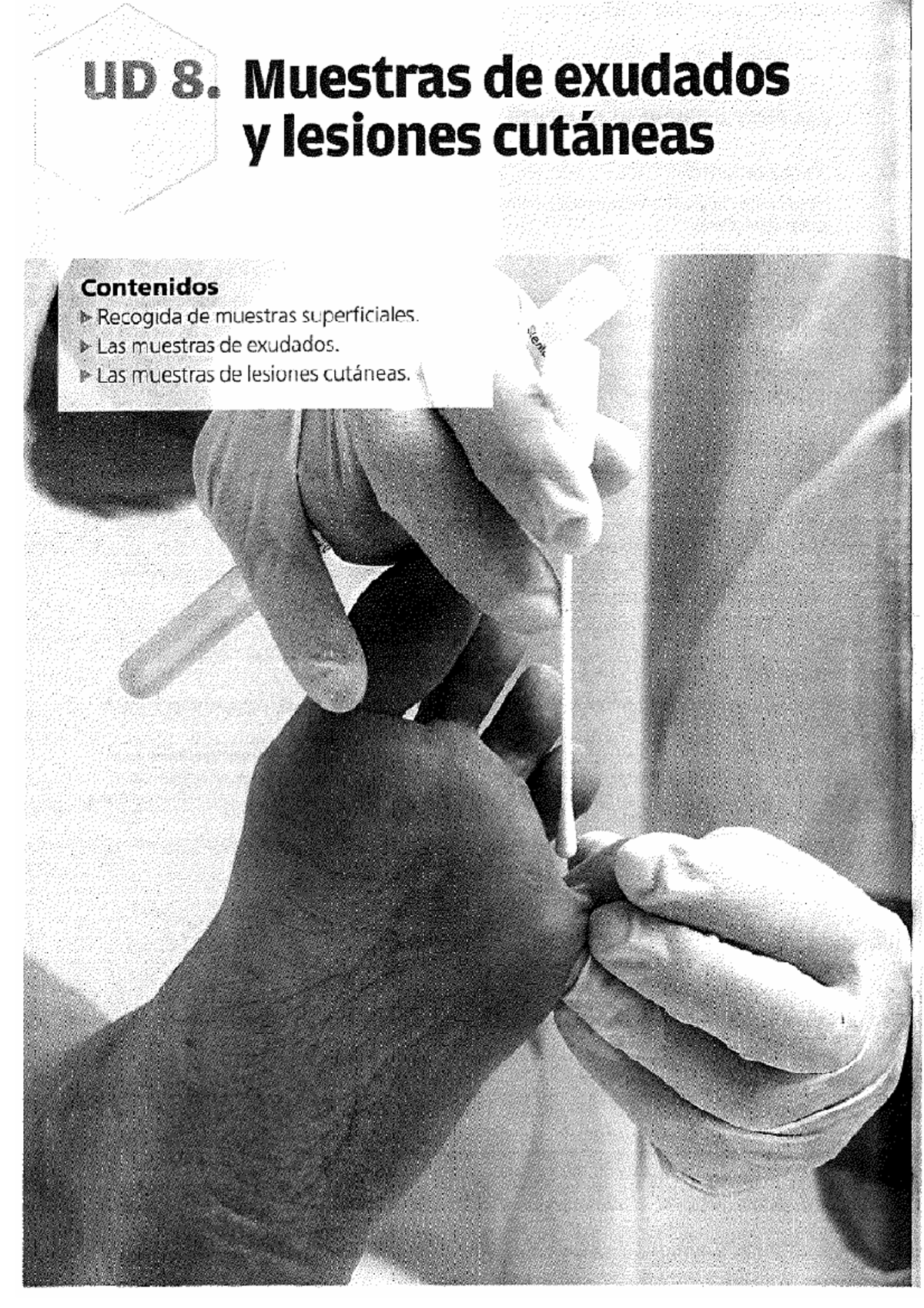 PDF Muestras de exudados y lesiones cutáneas - UD 8. Muestras de ...