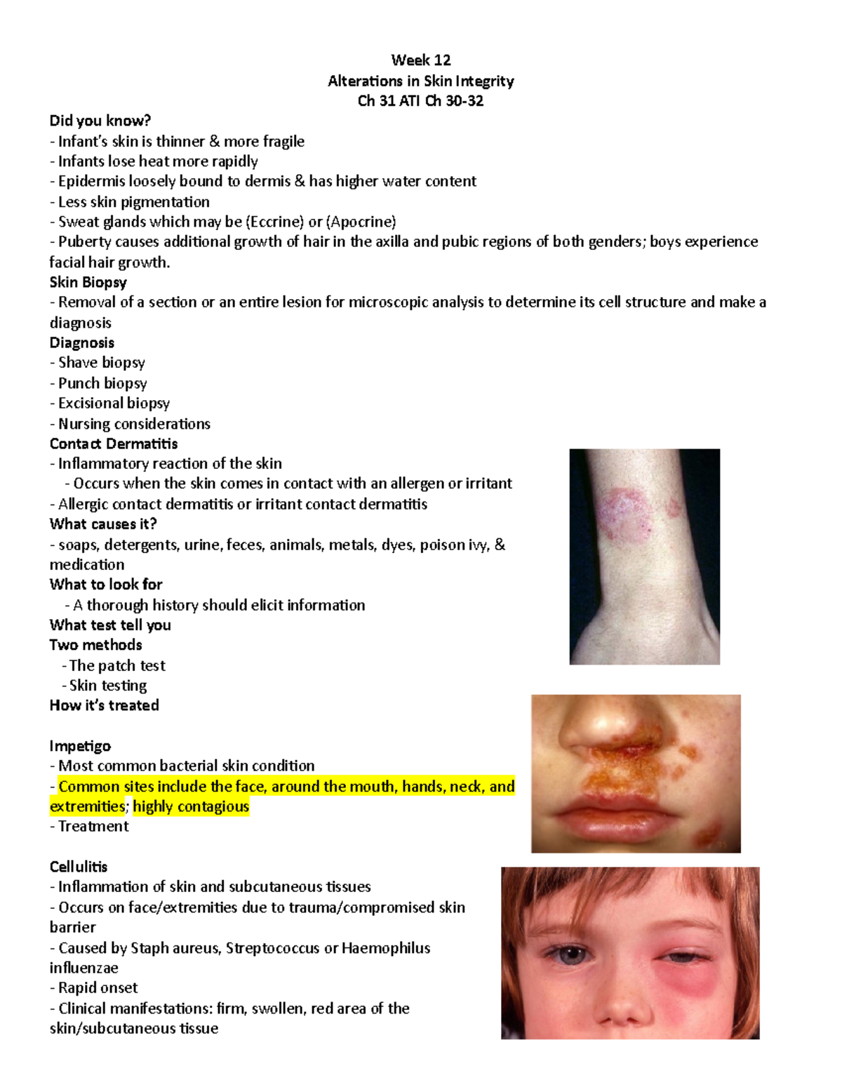 Week 12 pt 2 Alterations in Skin Integrity - Skin Biopsy Removal of a ...