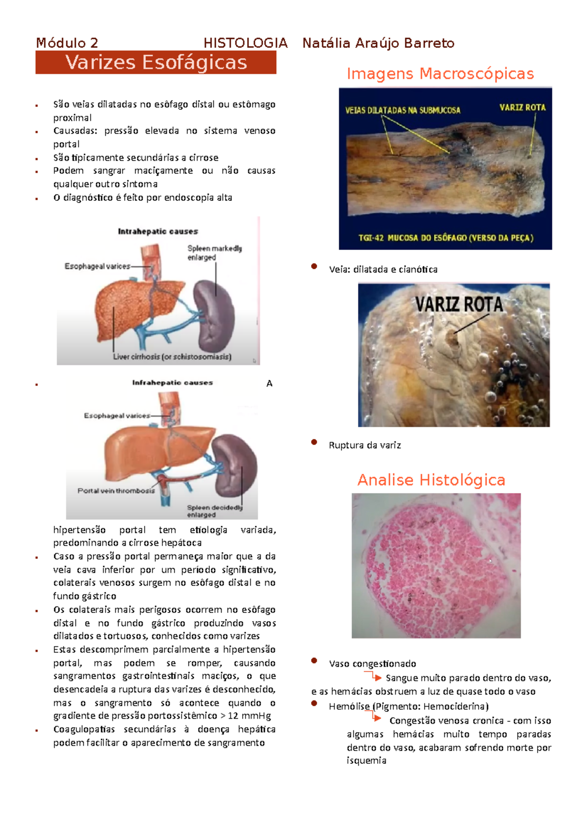 Varizes Esofágicas - Histologia - Módulo 2 HISTOLOGIA Natália Araújo ...