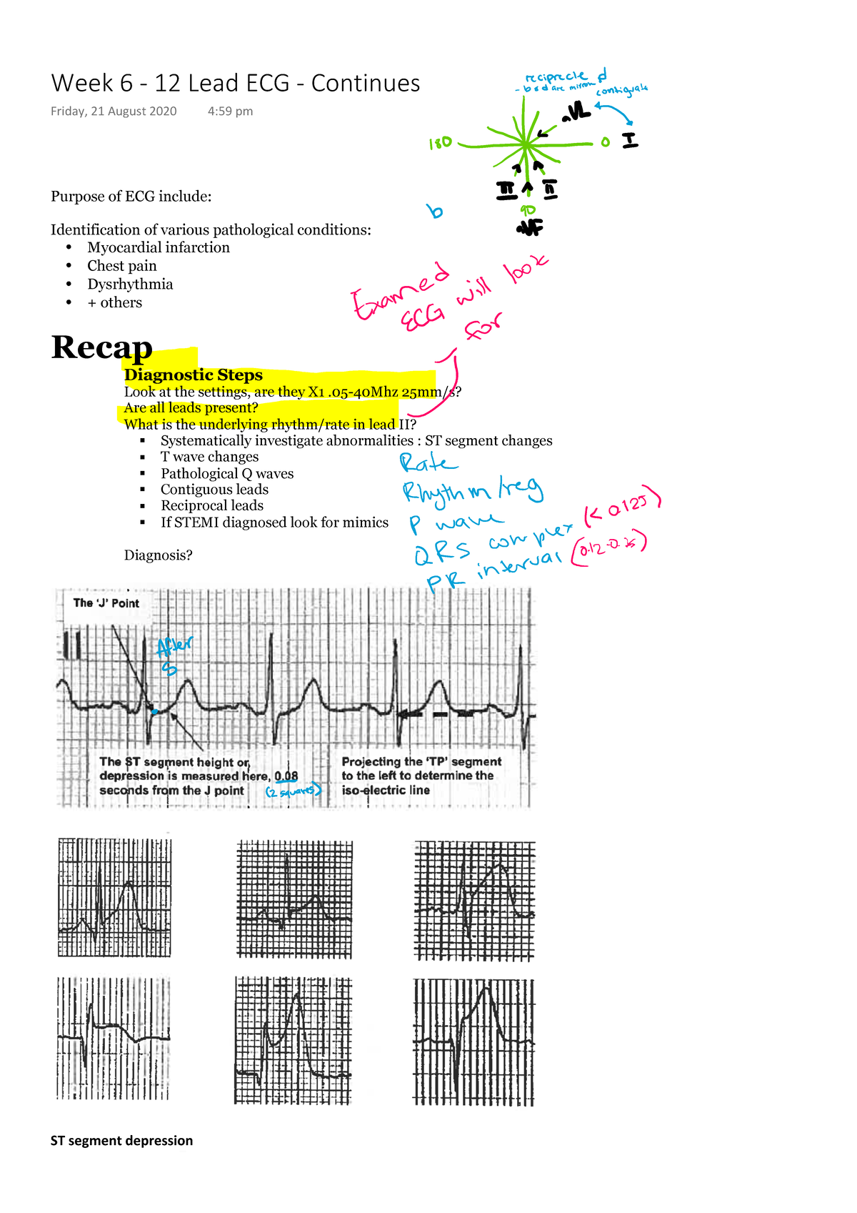 335 Week 6 - 12 Lead ECG - Continues - Warning: TT: undefined function: 32 Warning: TT ...