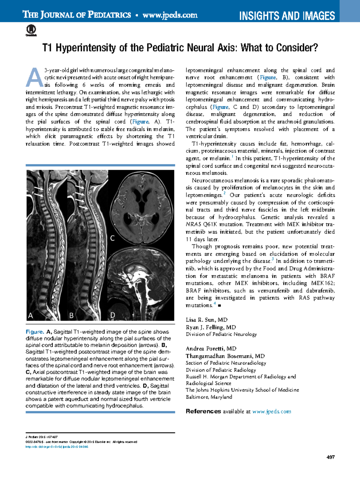 T1 Hyperintensity of the Pediatric Neural Axis Wh - On examination, she ...