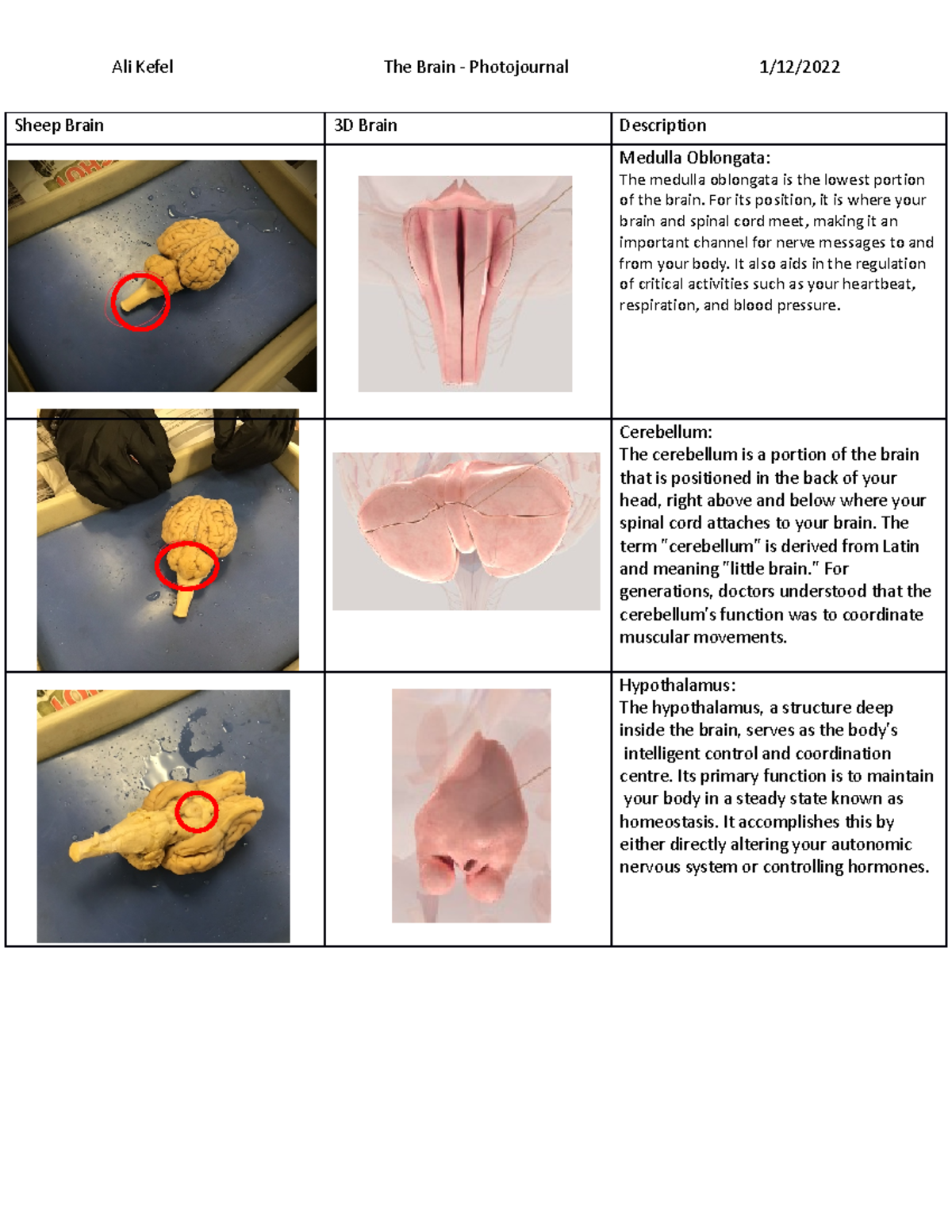 The Brain - Assignment Ali - Sheep Brain 3D Brain Description Medulla ...