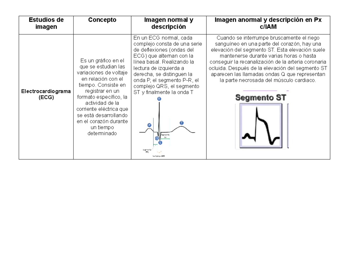 Estudios de imagen IAM e ICC - Estudios de imagen Concepto Imagen ...