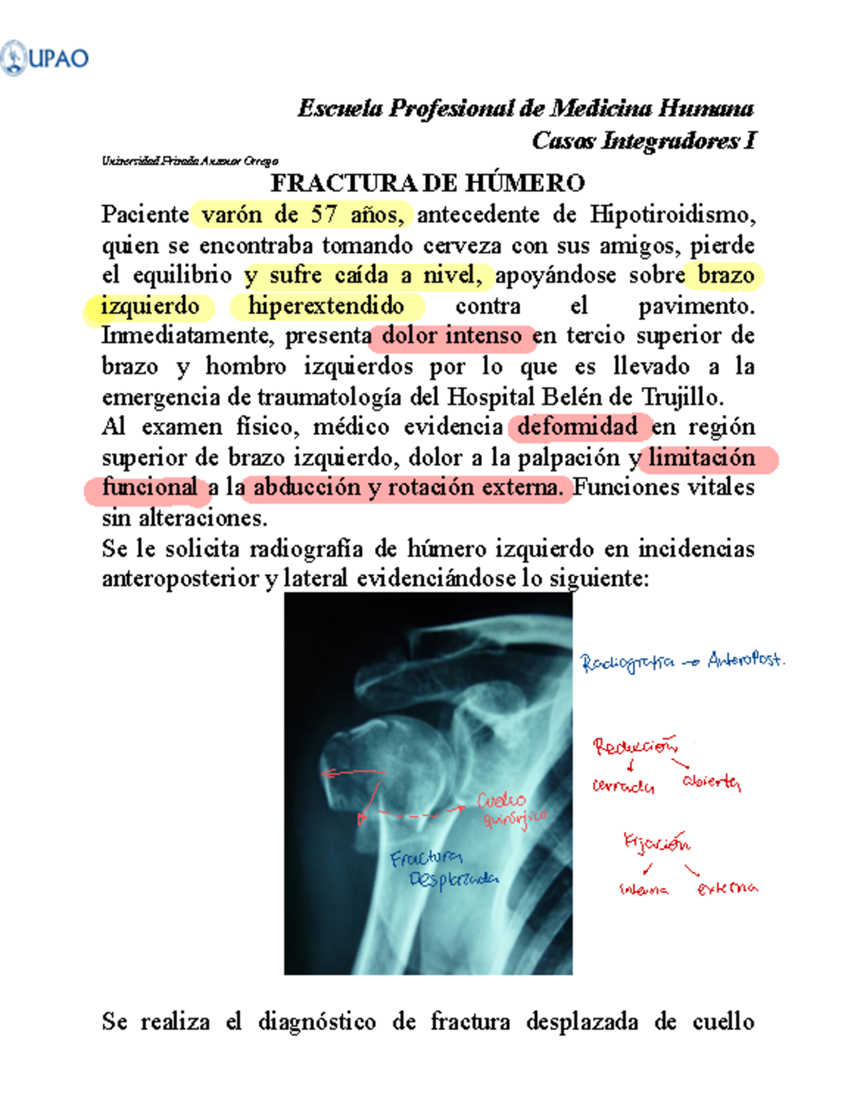 SEM 6 - Fractura de húmero - Escuela Profesional de Medicina Humana ...