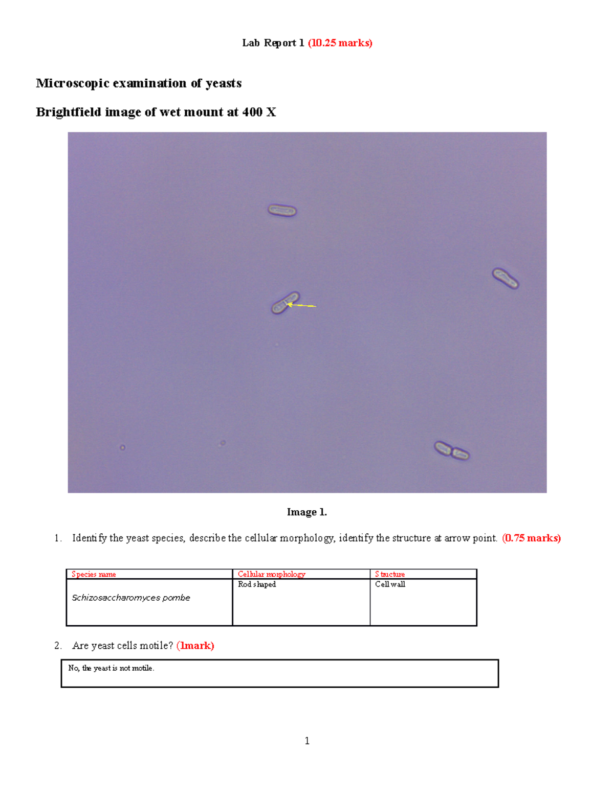 MICR2420 Lab Report 1 F21 - Lab Report 1 (10 marks) Microscopic ...