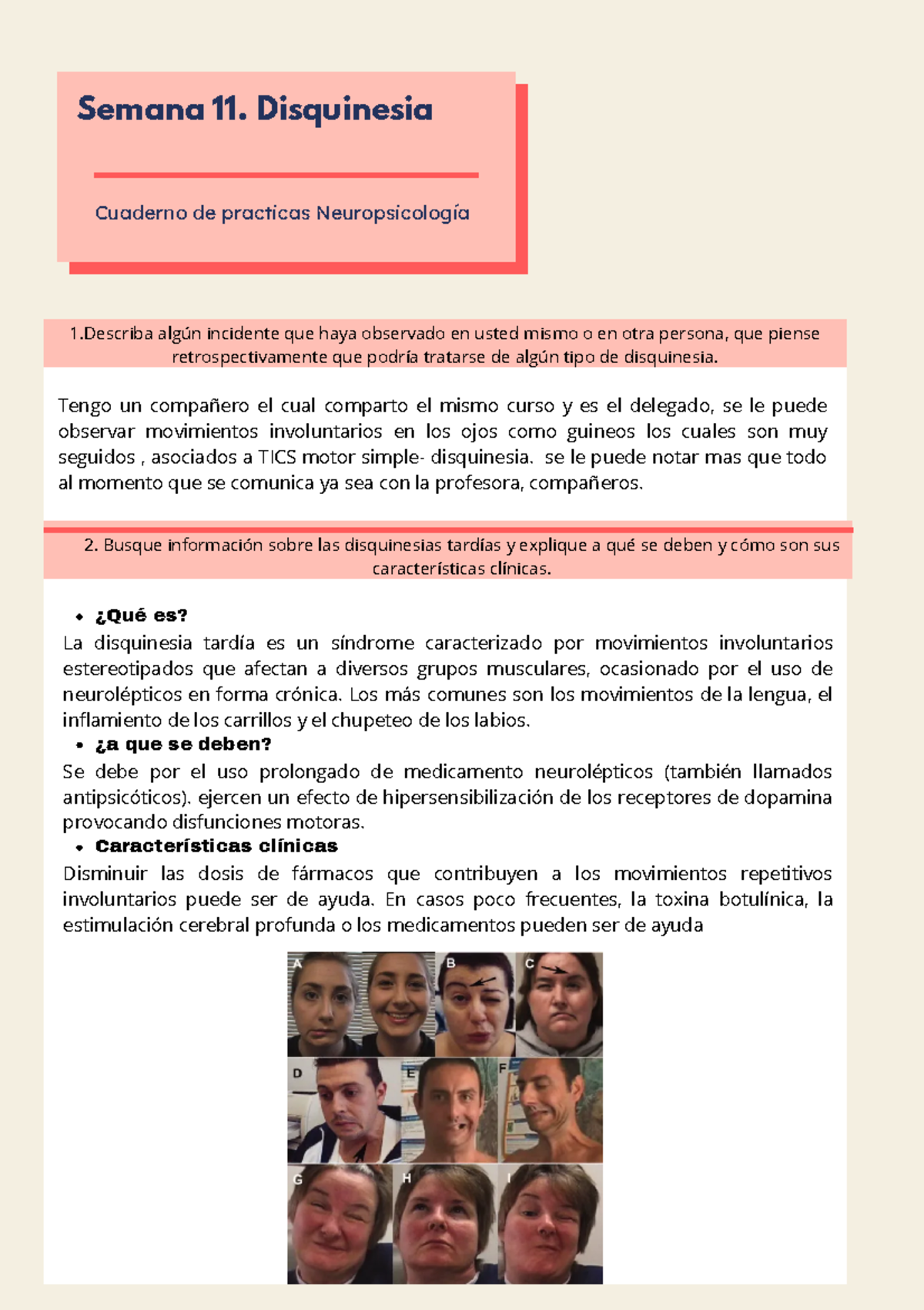 Disquinesia merged - bbbnnnnmmm - Semana 11. Disquinesia Cuaderno de ...