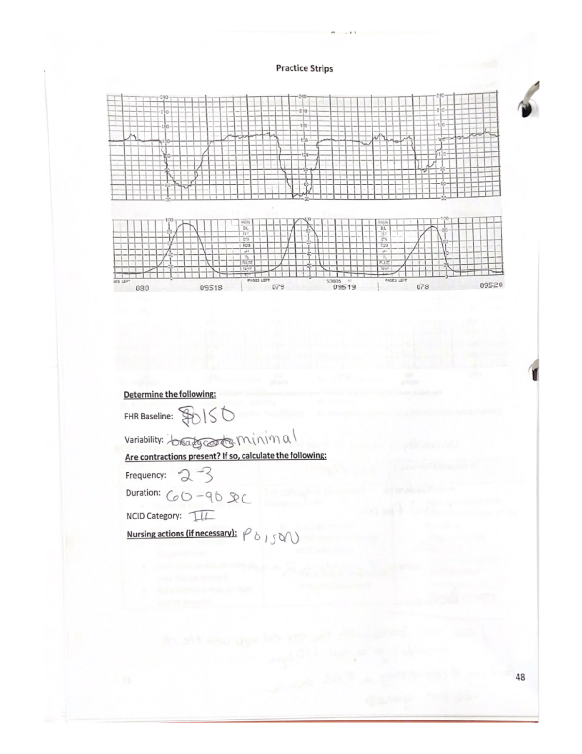 Practice Strips - Fetal strip - NUR 221 - Studocu