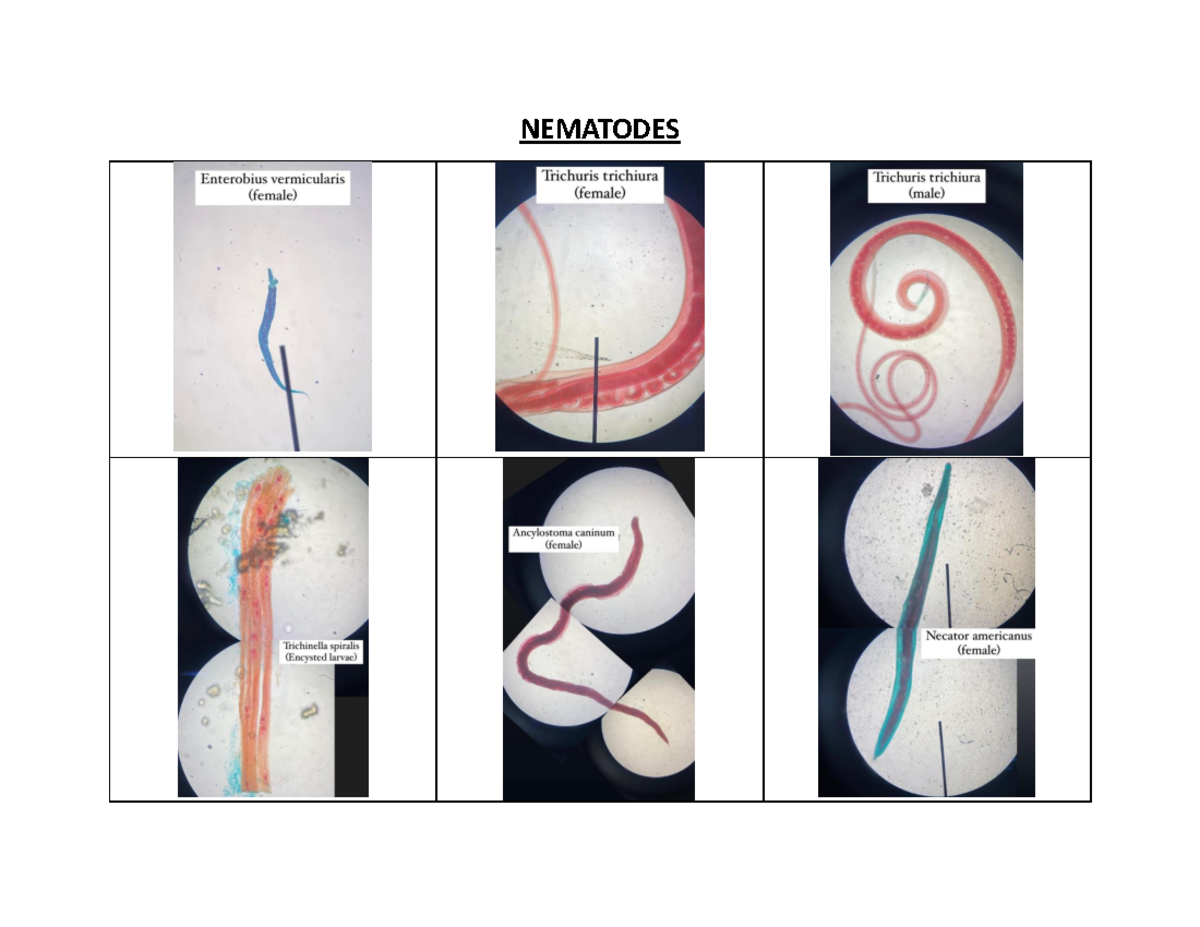 NEMA-CES- Trematodes - BS in Nursing - NEMATODES CESTODES TREMATODES ...