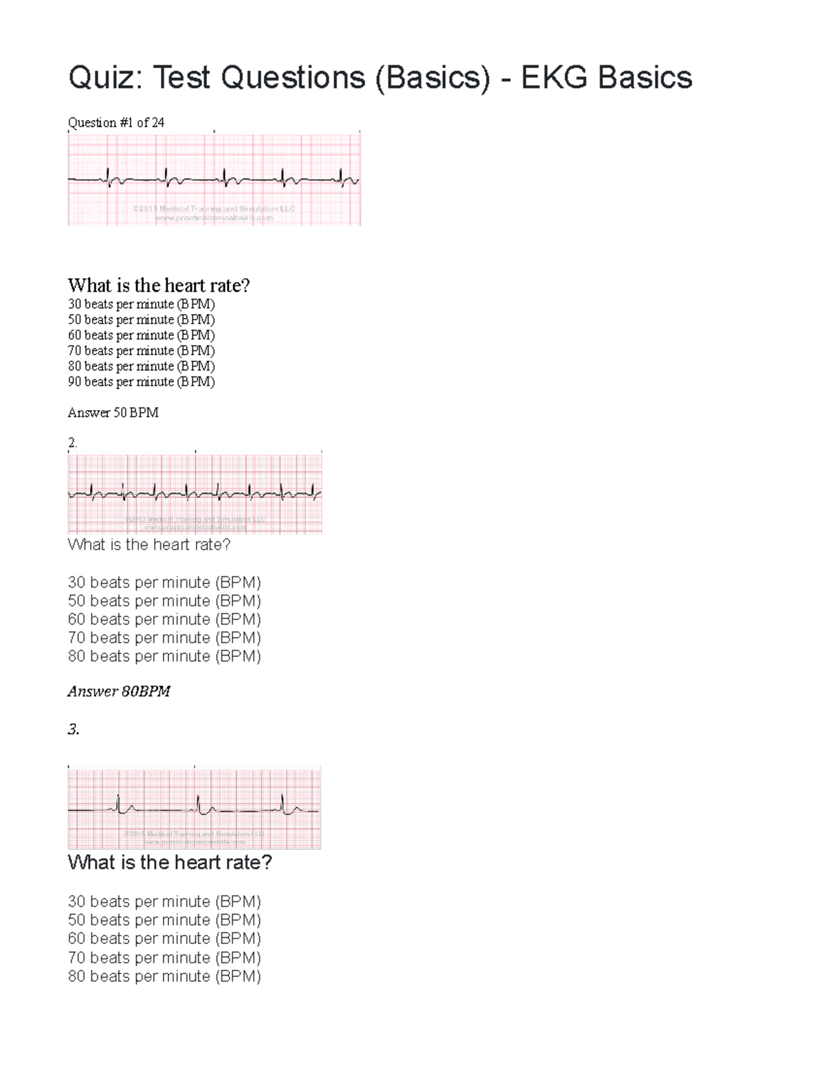 Quiz EKG - good to study by - Quiz: Test Questions (Basics) - EKG ...