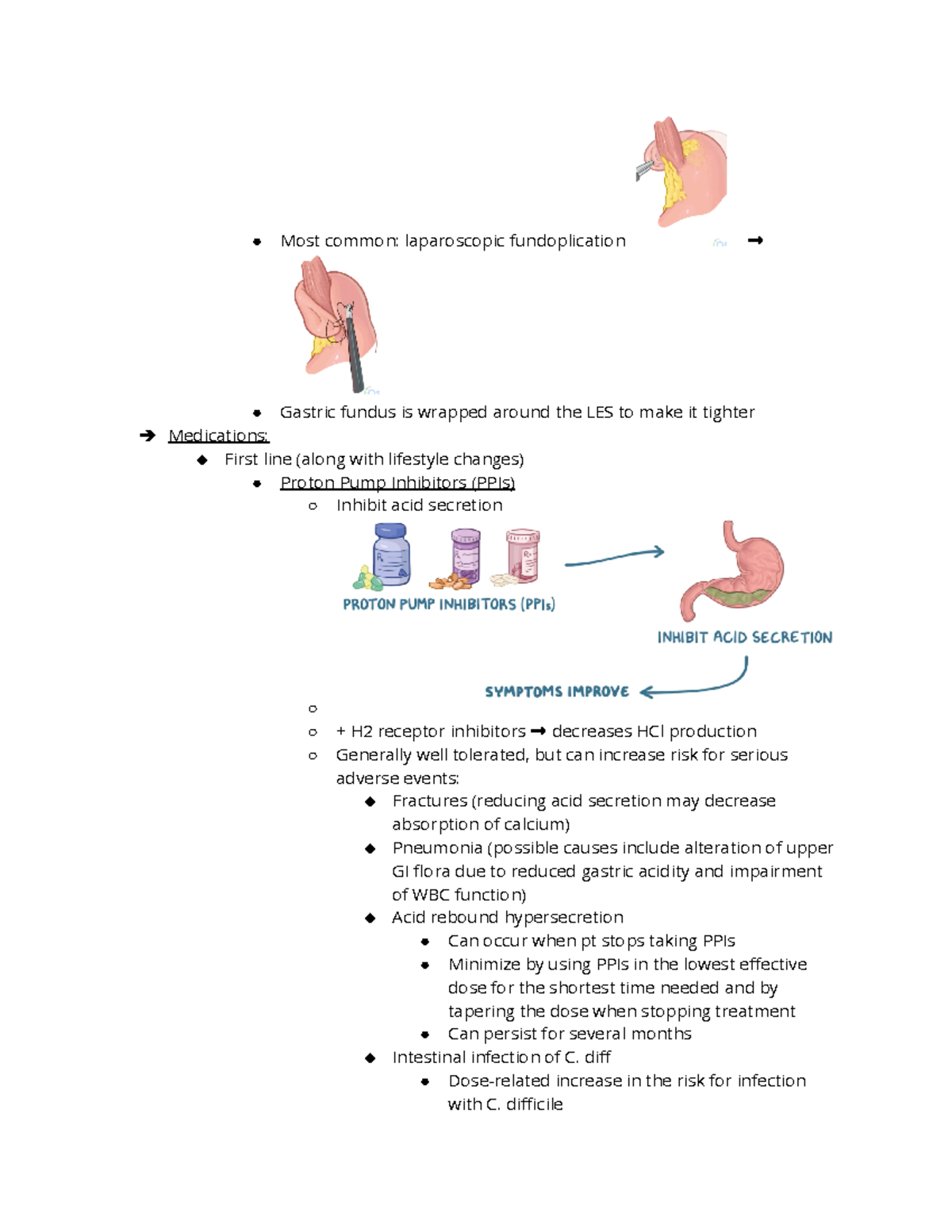 GI part 6 - GI notes - Most common: laparoscopic fundoplication → ...
