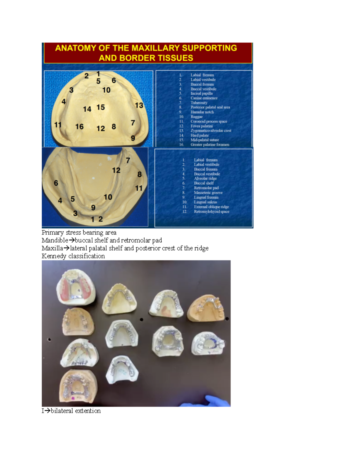 Rpd station overview copy - Primary stress bearing area Mandibleàbuccal ...