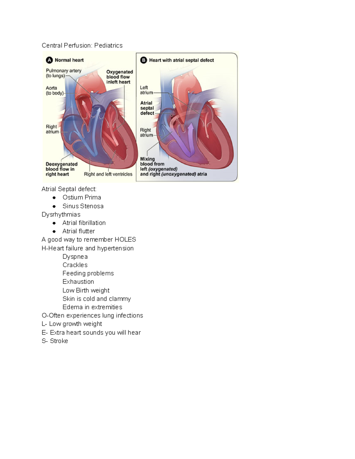 Central Perfusion Pediatrics - Central Perfusion: Pediatrics Atrial ...