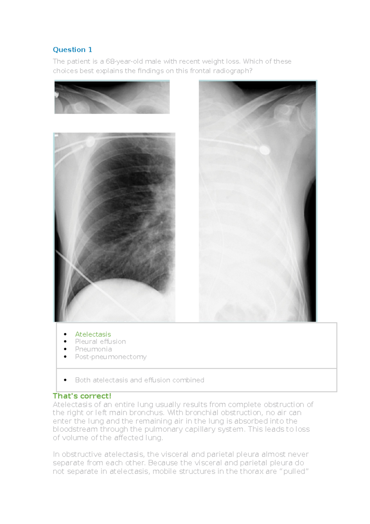 Quiz 5 ASDASD Question 1 The Patient Is A 68 year old Male With Quiz 5 ASDASD Question 1 The Patient Is A 68 year old Male With