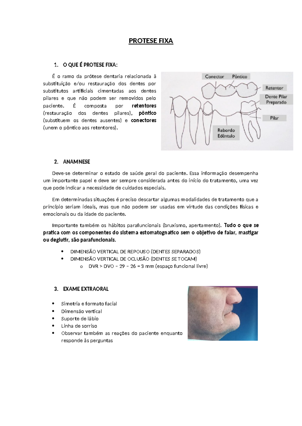 Resumo NP1 - PROTESE FIXA 1. O QUE É PROTESE FIXA: É o ramo da prótese ...