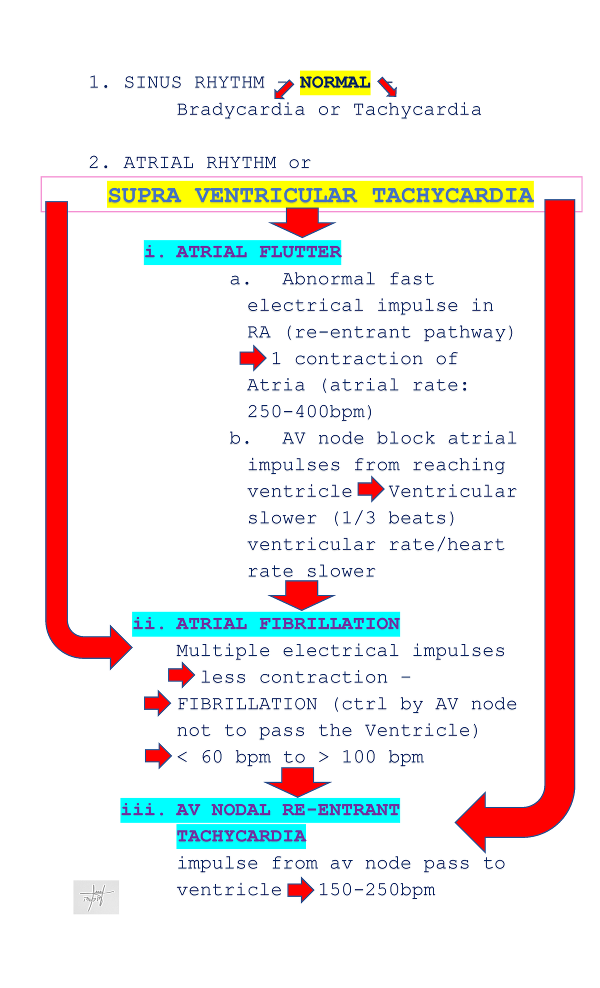 Arrythmias - for pharma - 1. SINUS RHYTHM – NORMAL - Bradycardia or ...