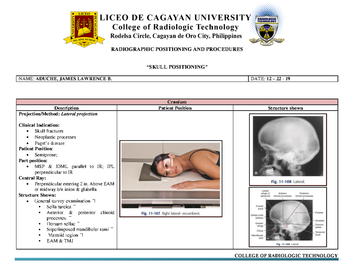 Skull Positioning - Read to pass the board exam :) - RADIOGRAPHIC ...