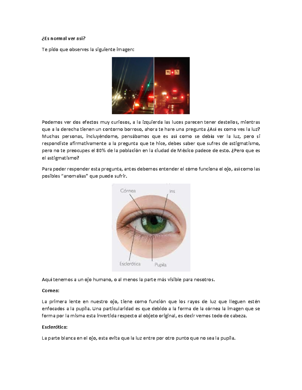 Ojo - Funcionamiento del ojo humano y sus defectos - ¿Es normal ver asi ...