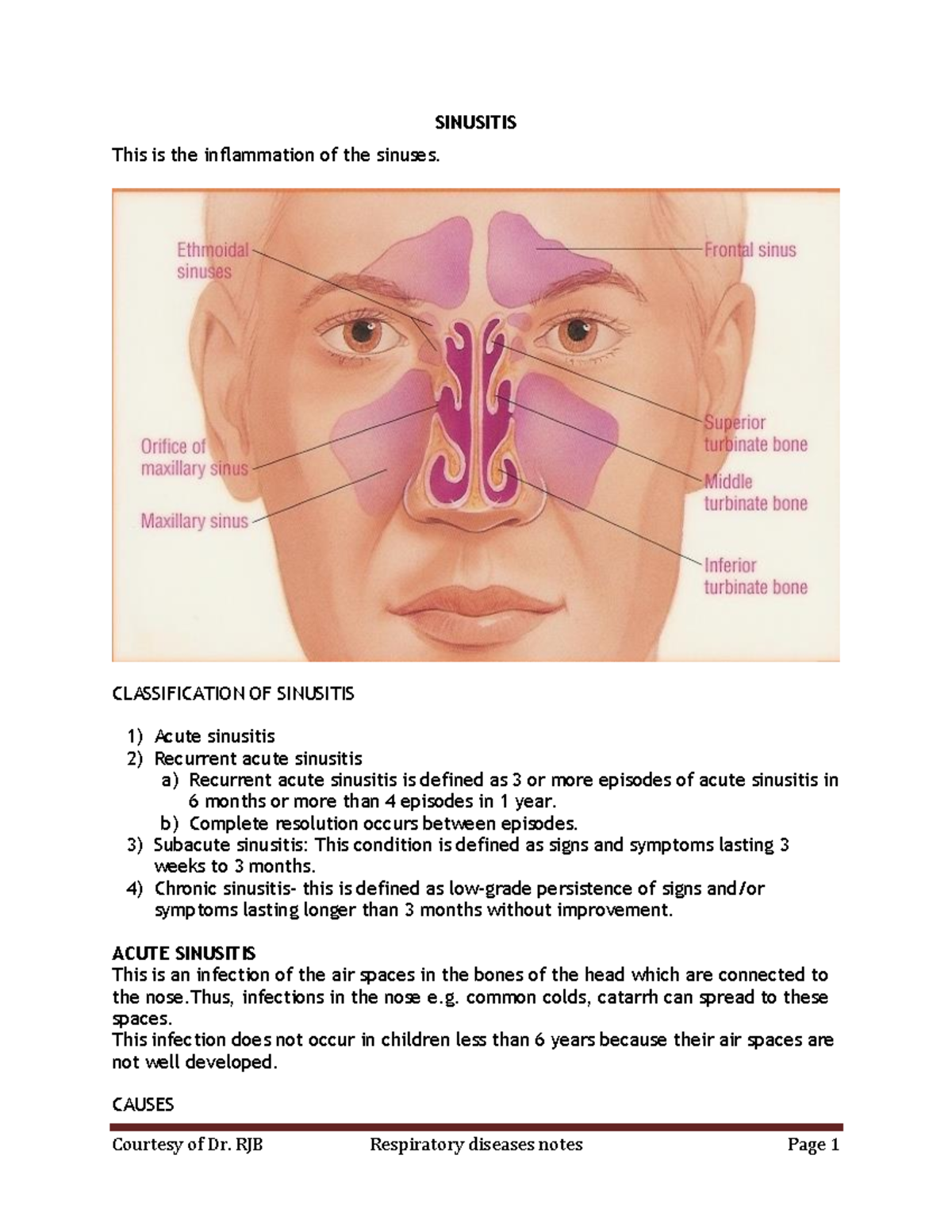 2 Sinusitis - Respiratory system notes - SINUSITIS This is the ...