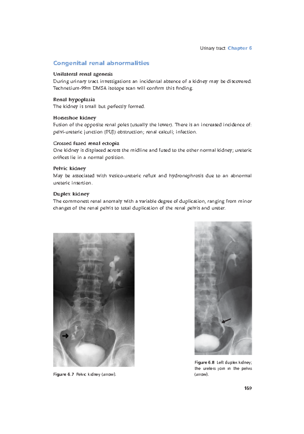 Radiology Lecture Notes pdf (57) - Urinary tract Chapter 6 169 Figure 6 ...