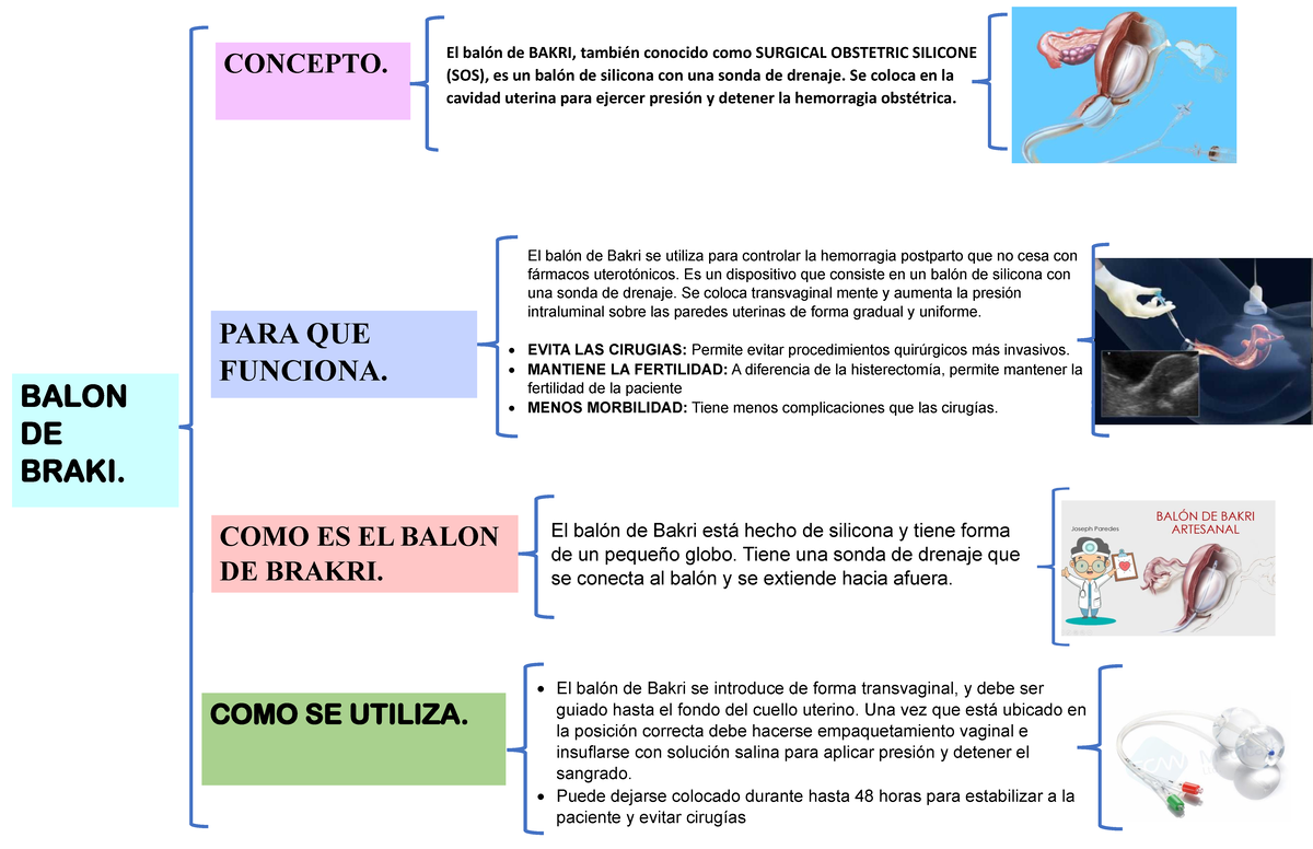 Balon de braki - BALON DE BRAKI. CONCEPTO. El balón de BAKRI, también ...