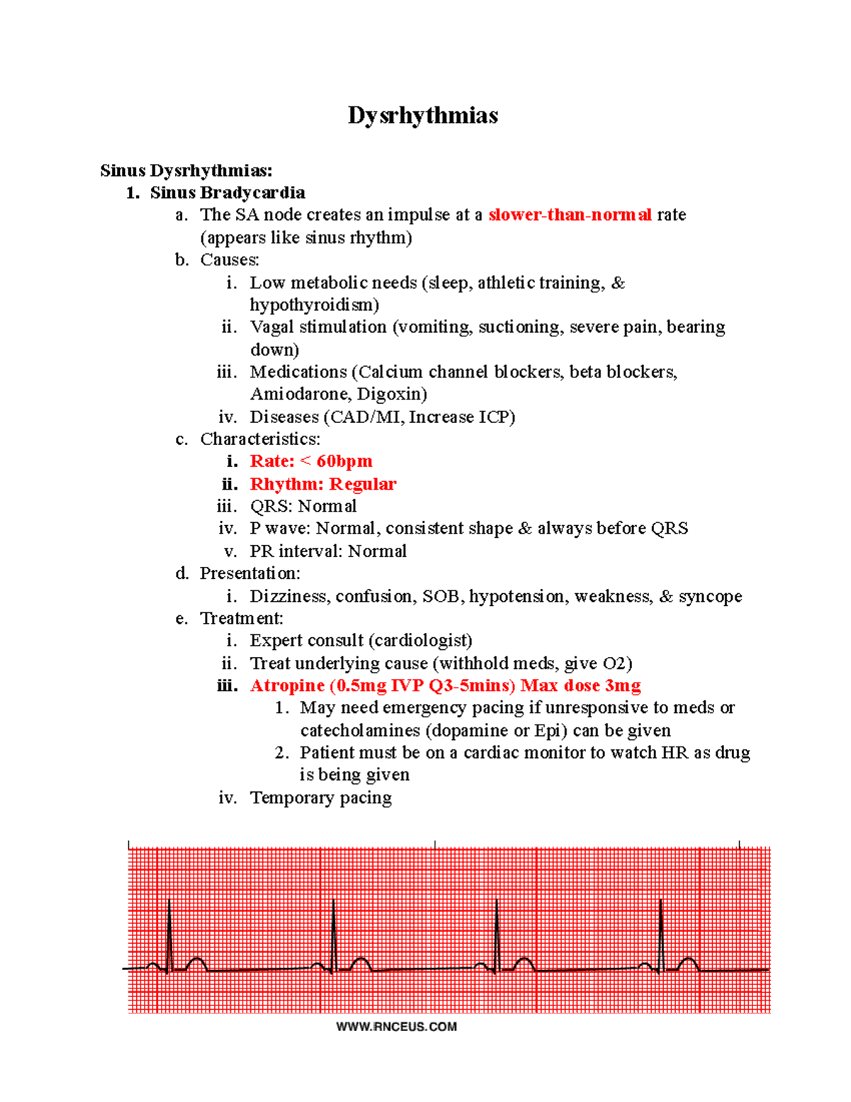Dysrhythmias Outline - n/A - Dysrhythmias Sinus Dysrhythmias: 1. Sinus ...