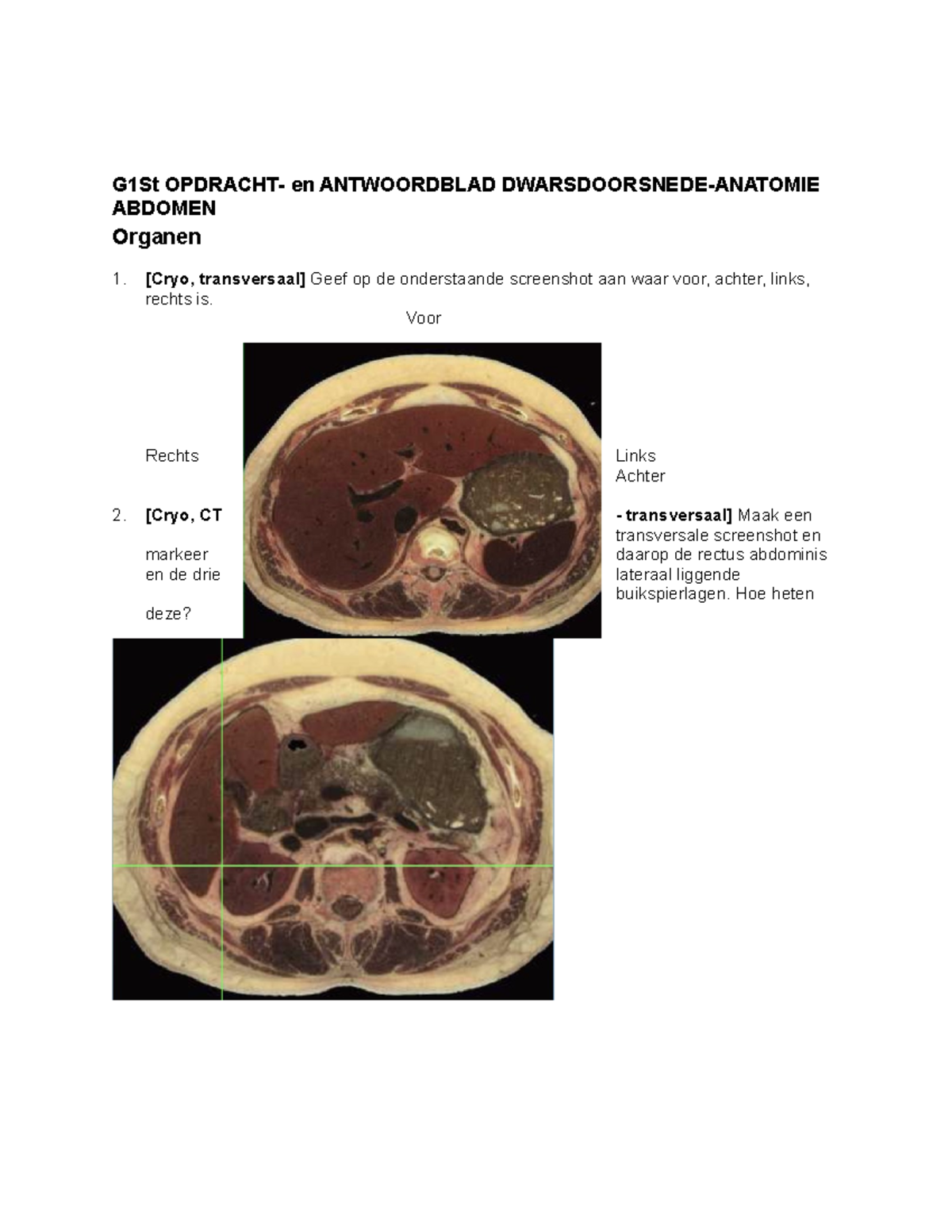 G1St Opdracht EN Antwoordblad Dwarsdoorsnede- Anatomie Abdomen-3 - G1St ...