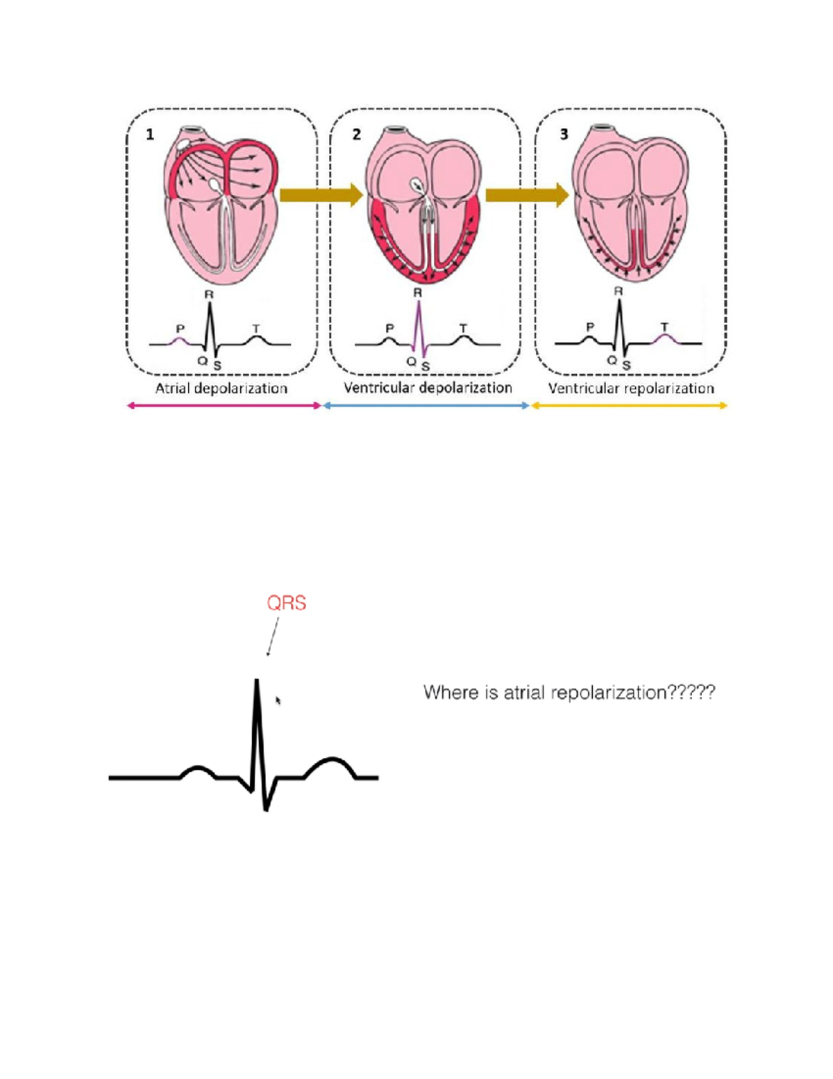 ECG - Basic ECG Cheatsheet - ANAT 7010 - Studocu